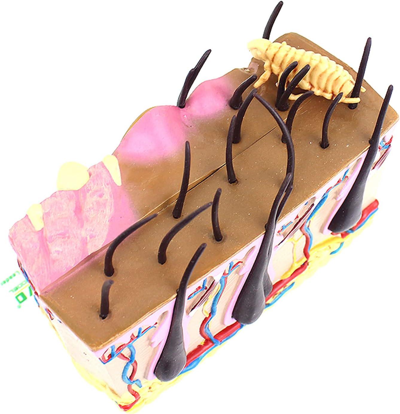 Dog Skin Model Insect Bite Pathology Mite Flea Hair Subcutaneous Tissue ...