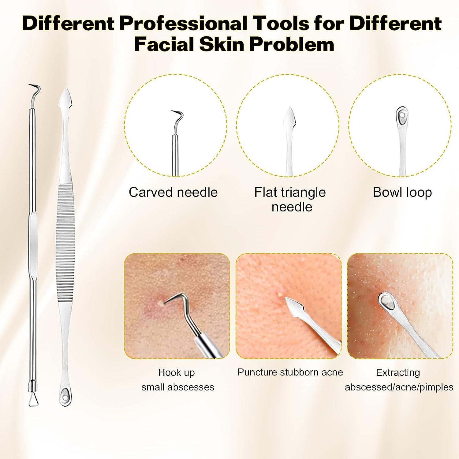 iSmartPart 20Pcs Blackhead Remover Tools Kit - Professional Stainless ...