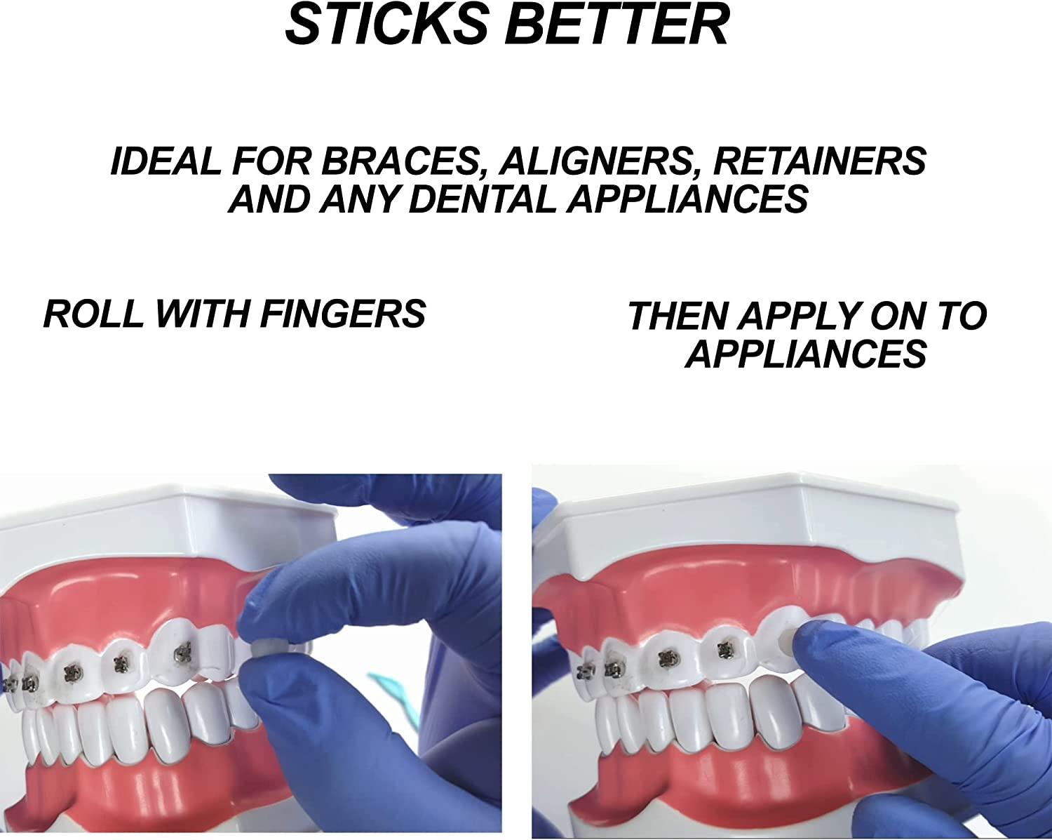 Genuine Orthowax - Superior Orthodontic Wax for Braces - Best Adhesion ...