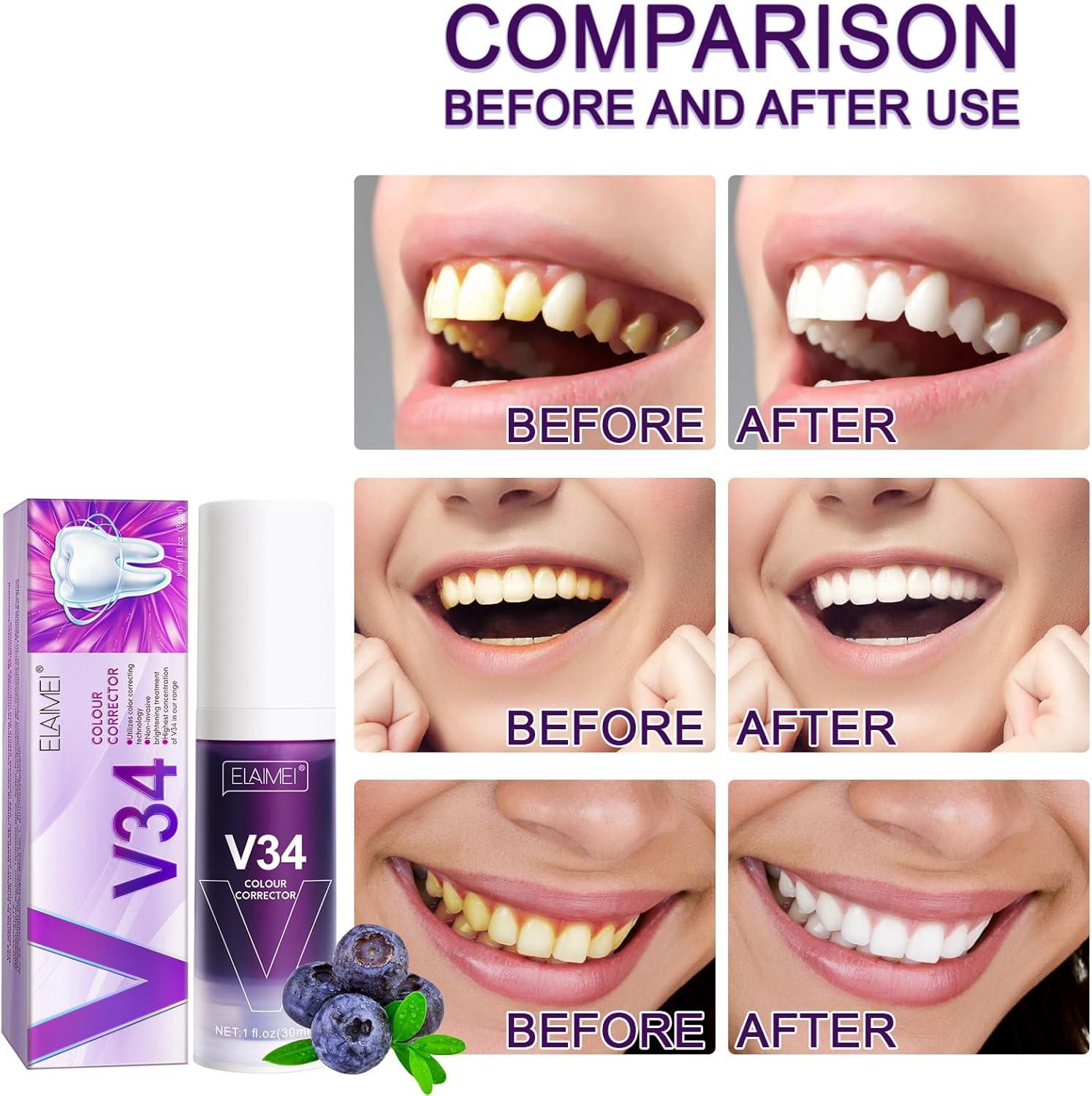 V34 Purple Toothpaste for Whiter Teeth | Frilla Oral Foam & Stain ...