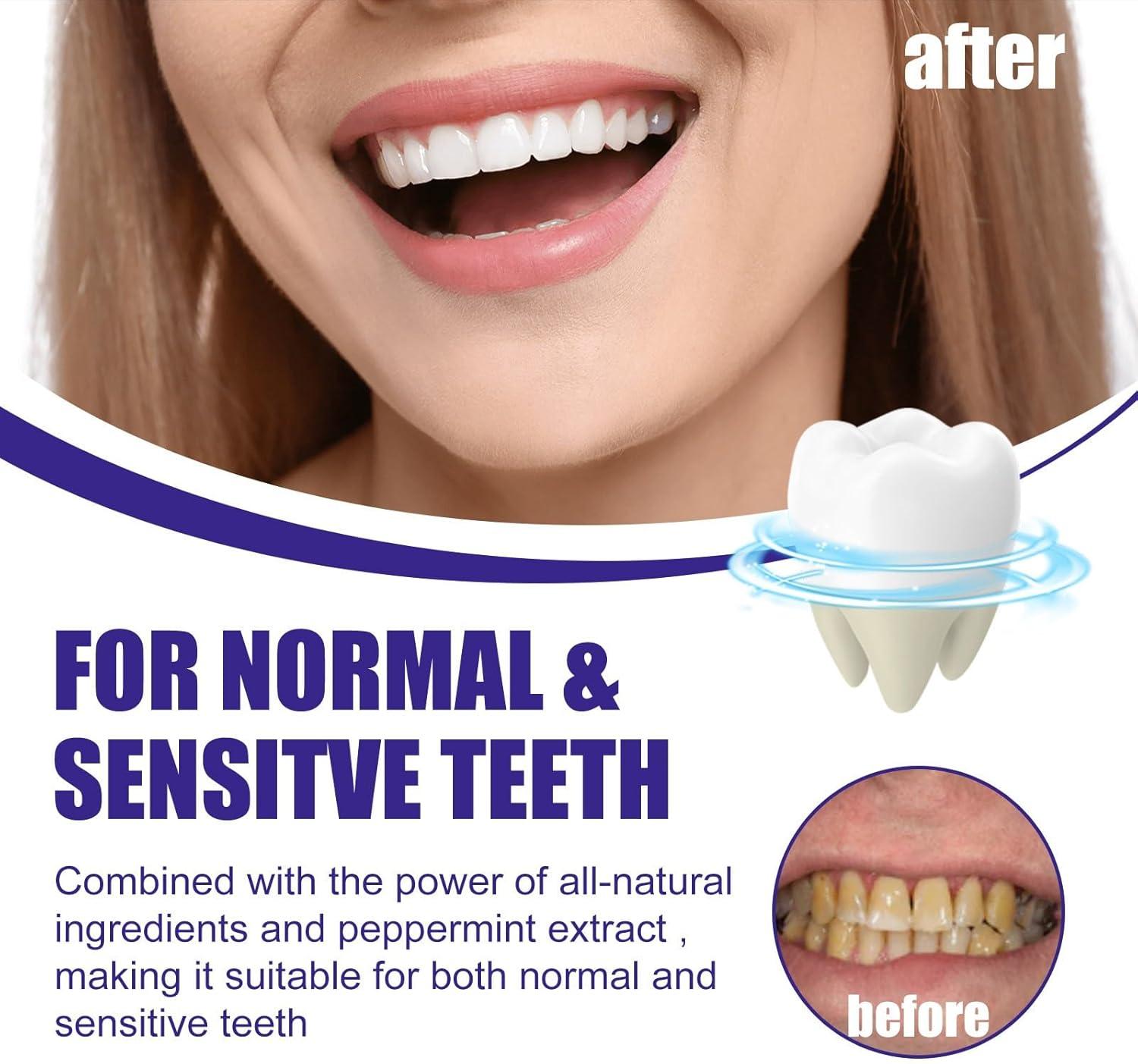 3 Days Tooth Elevator Powder & Stain Remover - Safe for Enamel Purple ...