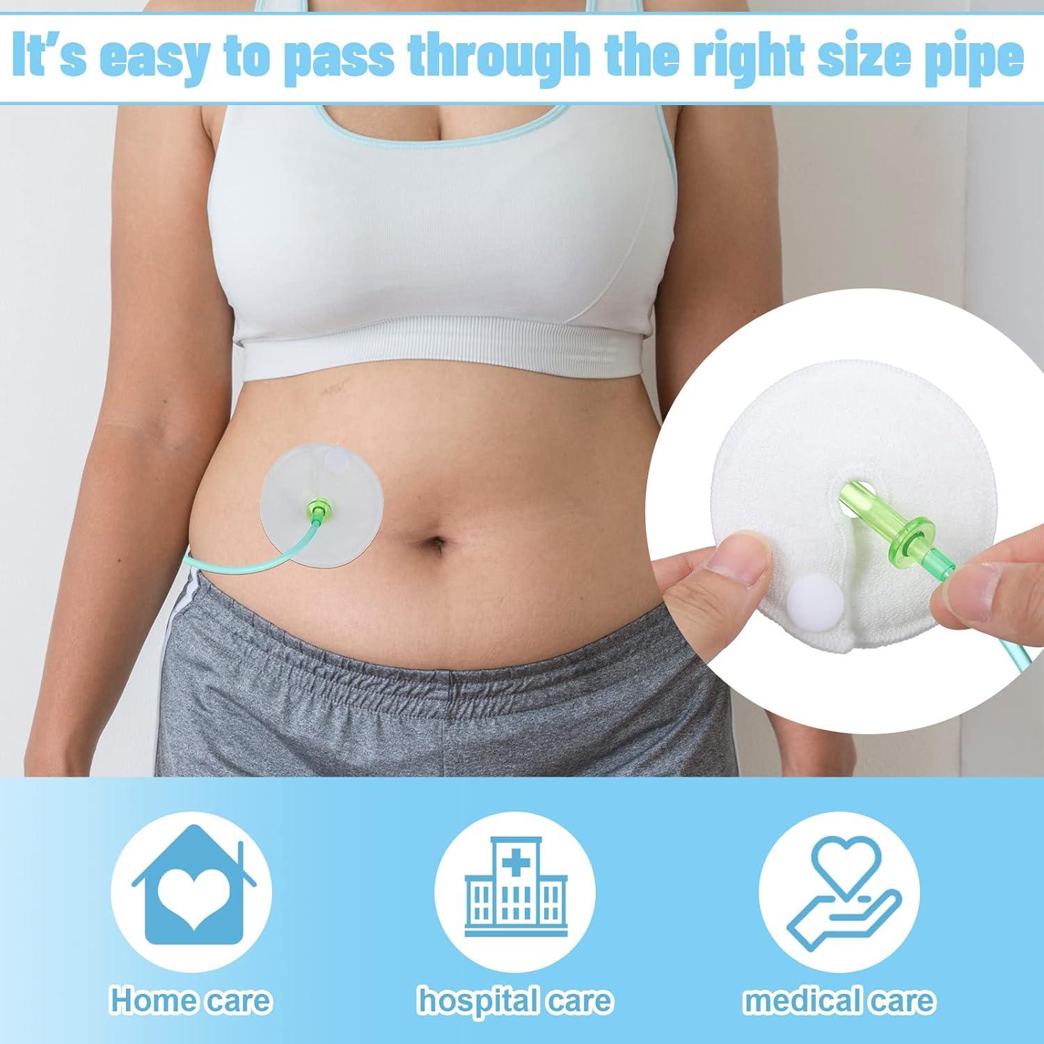 56 Pack G Tube Button & Peg Tube Covers - Soft Cotton Peritoneal ...