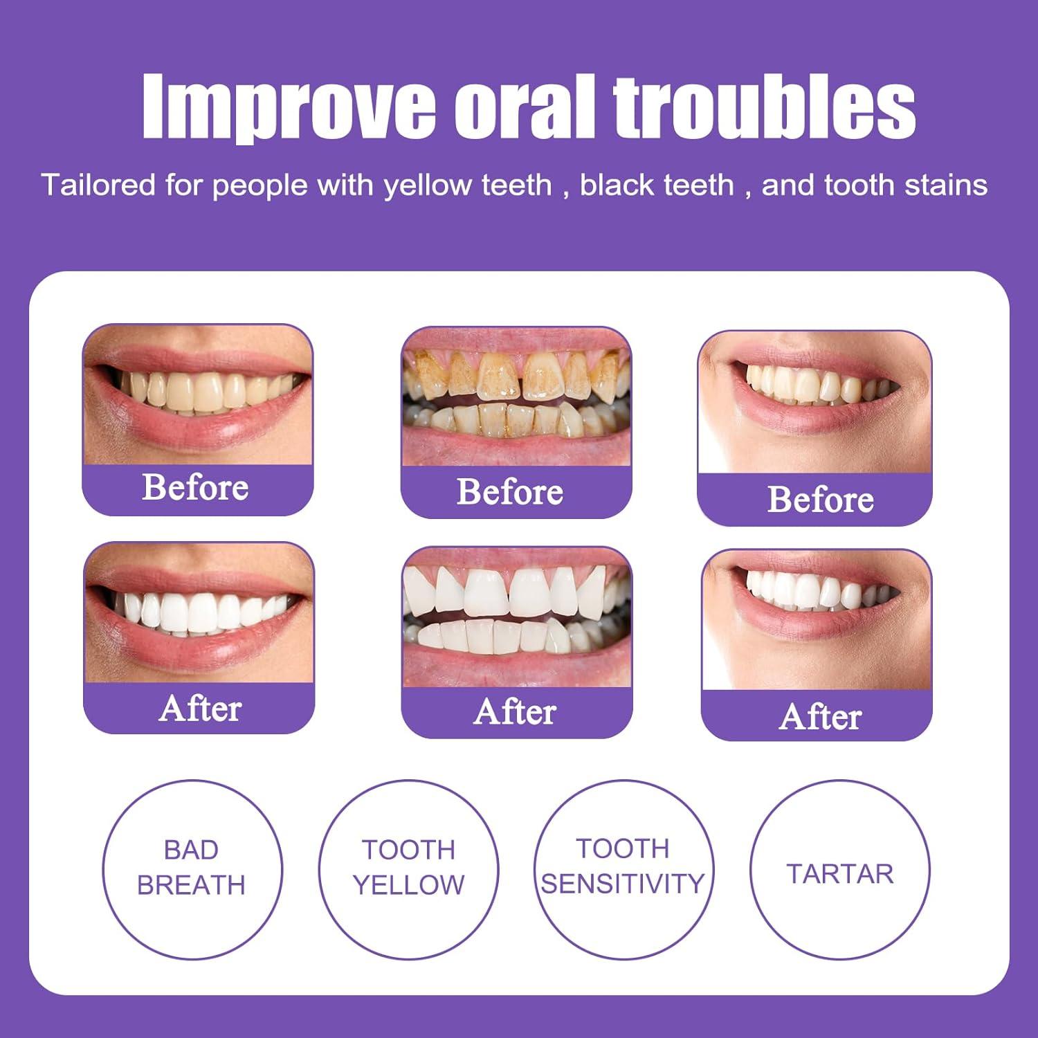 Whitening Toothpaste for White Teeth | Purple Tea Infused Teeth ...