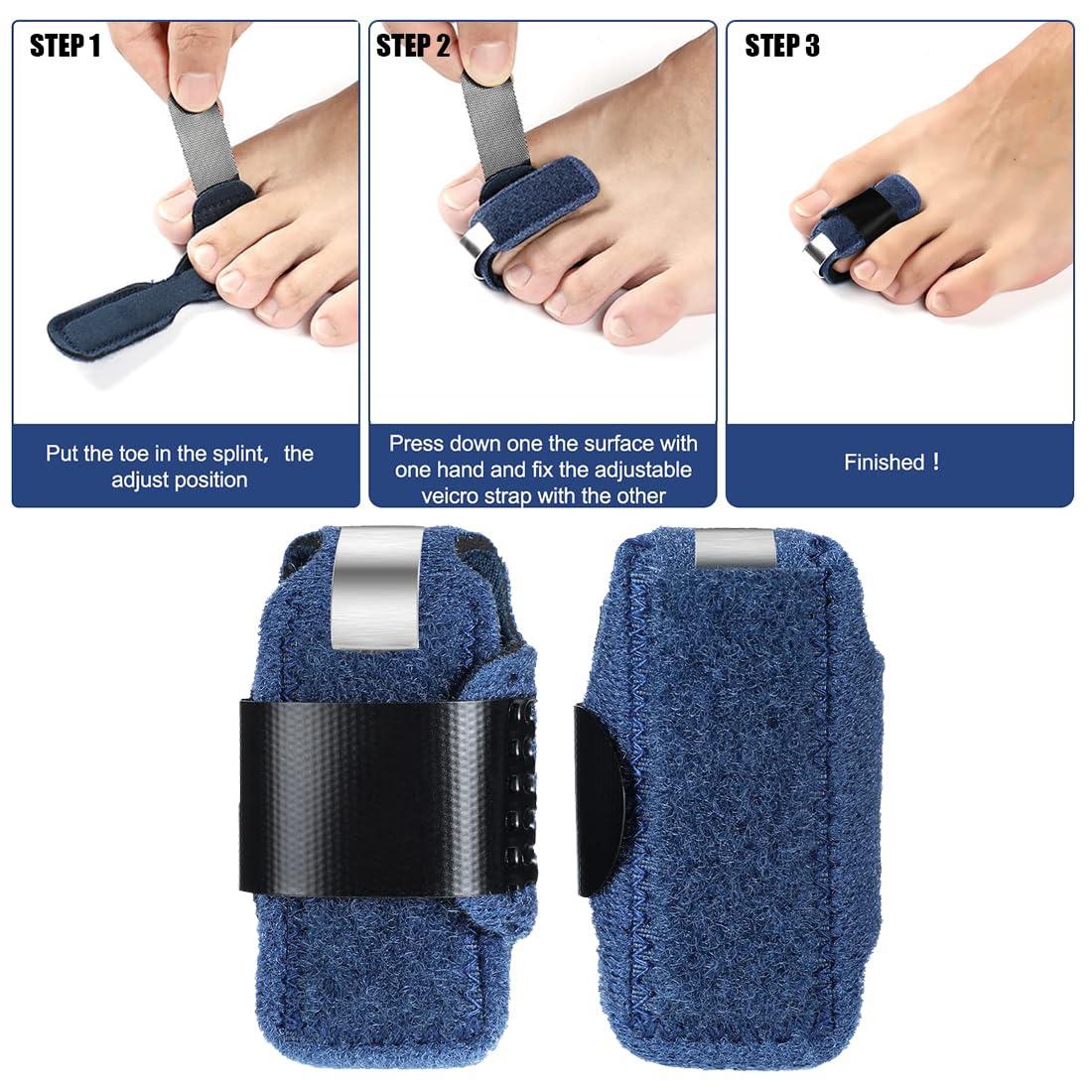 Linxiu 2-Piece Toe Rail Hammer & Toe Extenders for Broken & Claw Toes ...