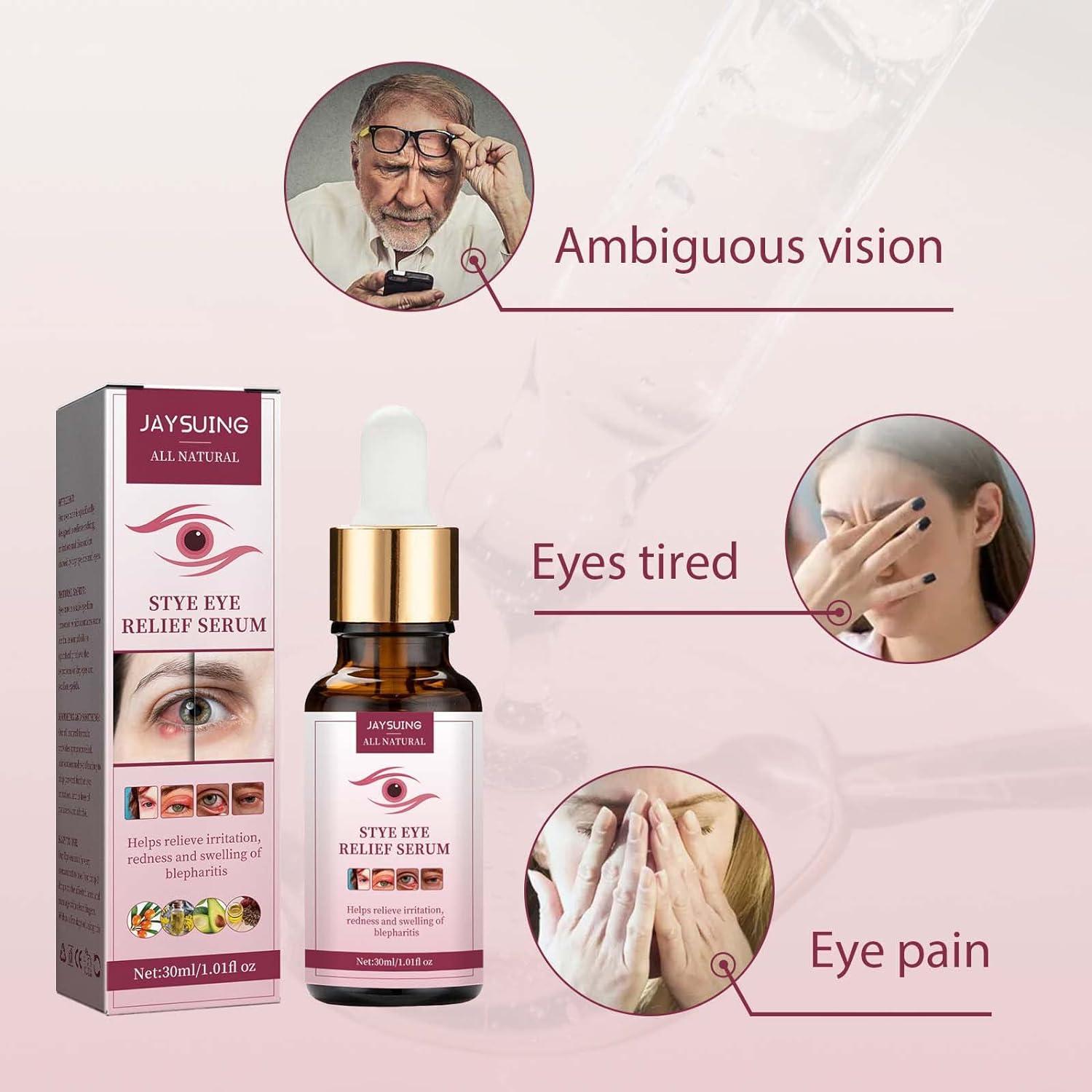 Stye Eye Treatment Serum - Fast Relief for Styes, Chalazion ...