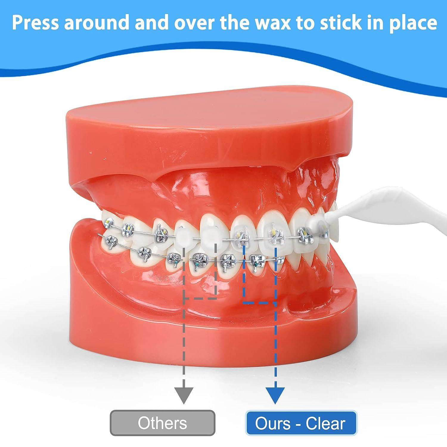 Braces Wax 10 Pack with 50 Precut Wax Strips - Food-Grade Dental Wax ...