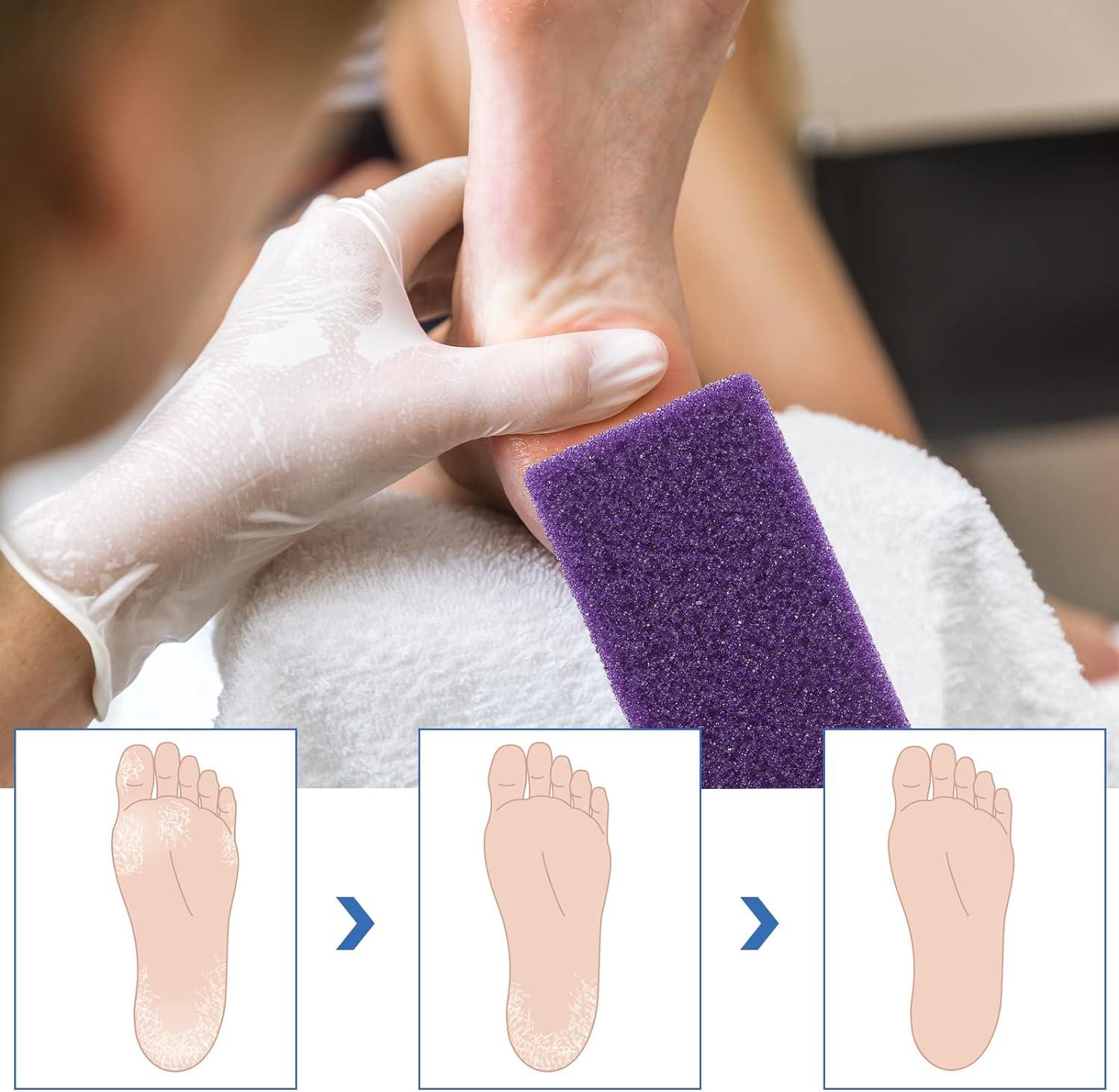 Healifty 6pcs Pumice Stone Callus Remover Foot Care Kit - Purple ...