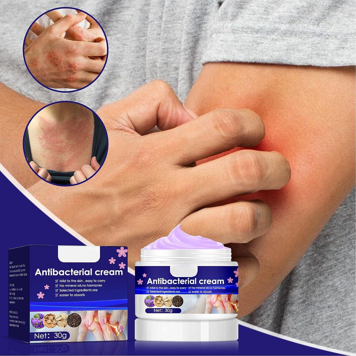 30g Anti Itch Hydrating Cream for Fast Relief of Skin Irritation and ...