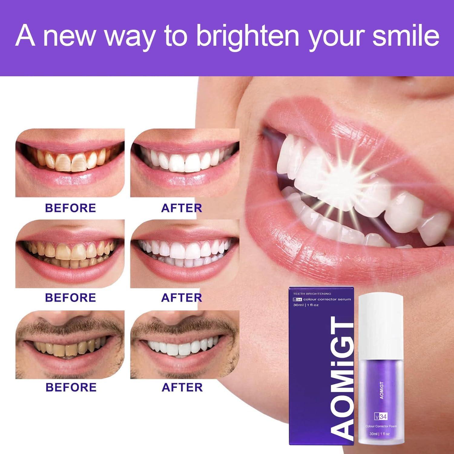 Teeth Whitening Toothpaste | Purple Toothpaste for White Teeth & Stain ...