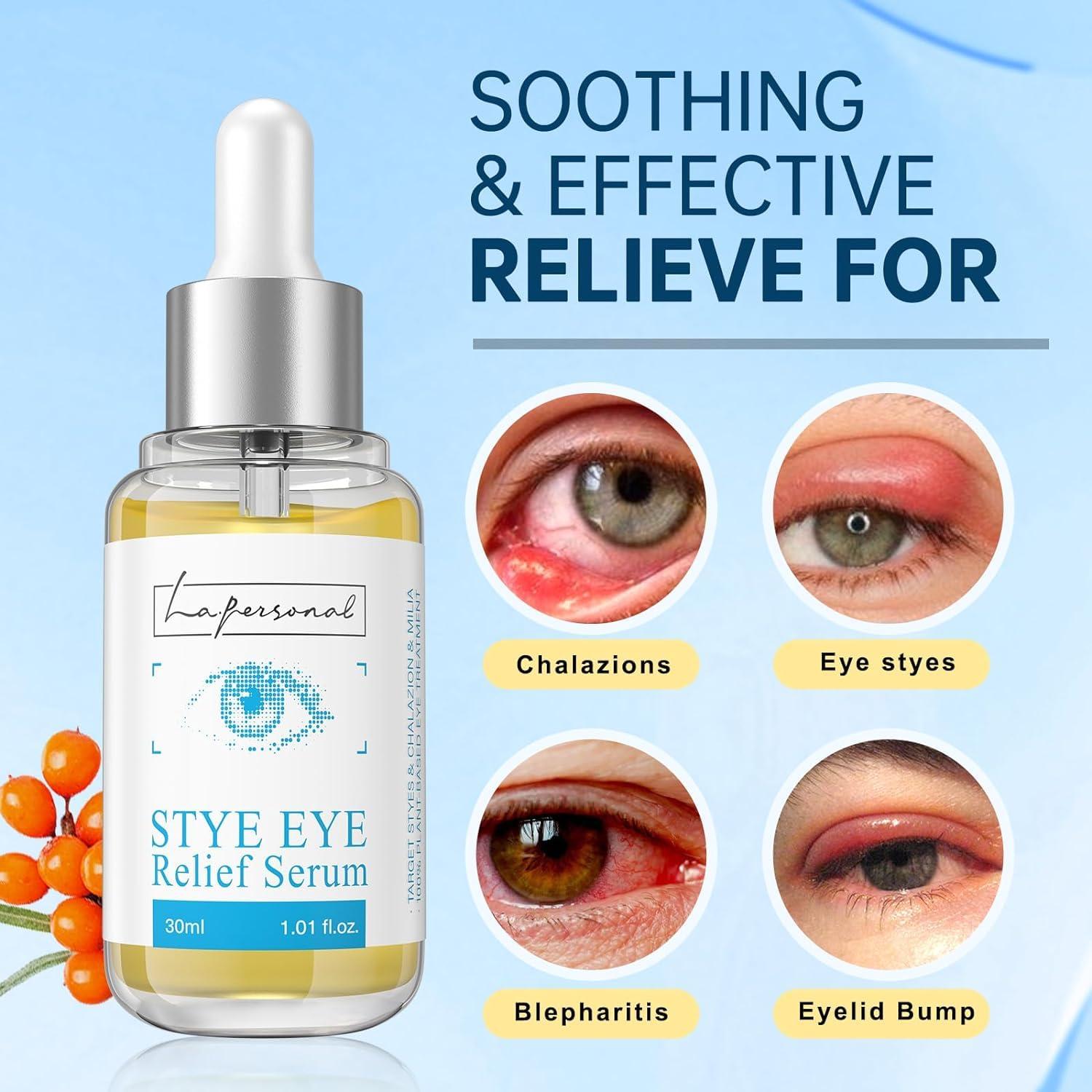 Stye Eye Serum 30ml | Vegan Relief for Styes Chalazion & Blepharitis ...