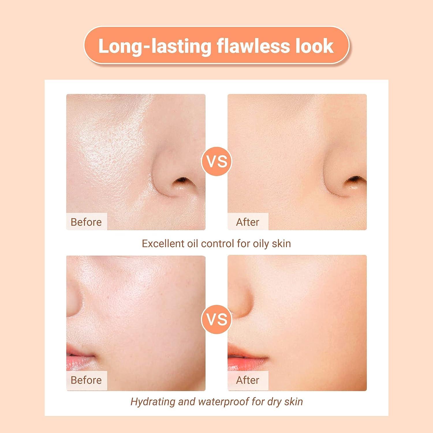 medium pores
