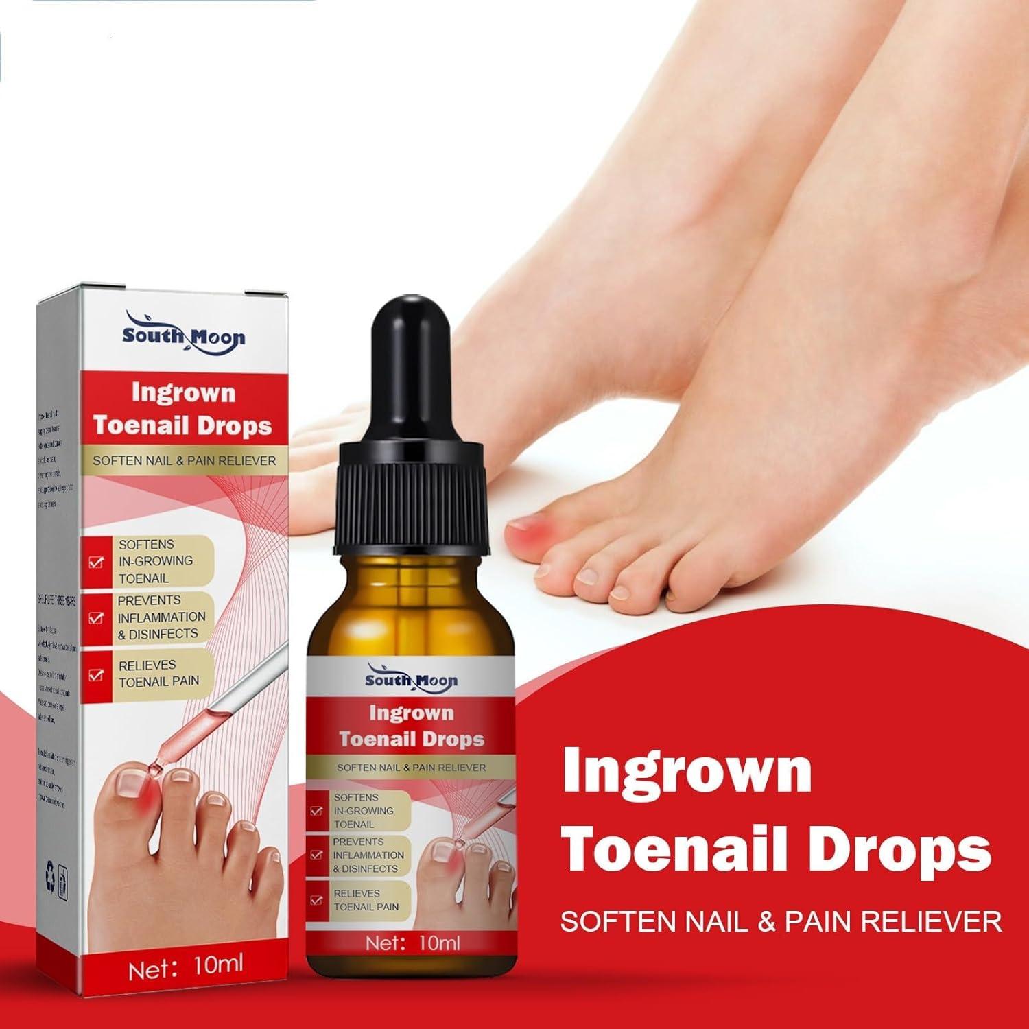 VIDIND Ingrown Toenail Correction Oil Ingrown Toenail Correction Drops ...