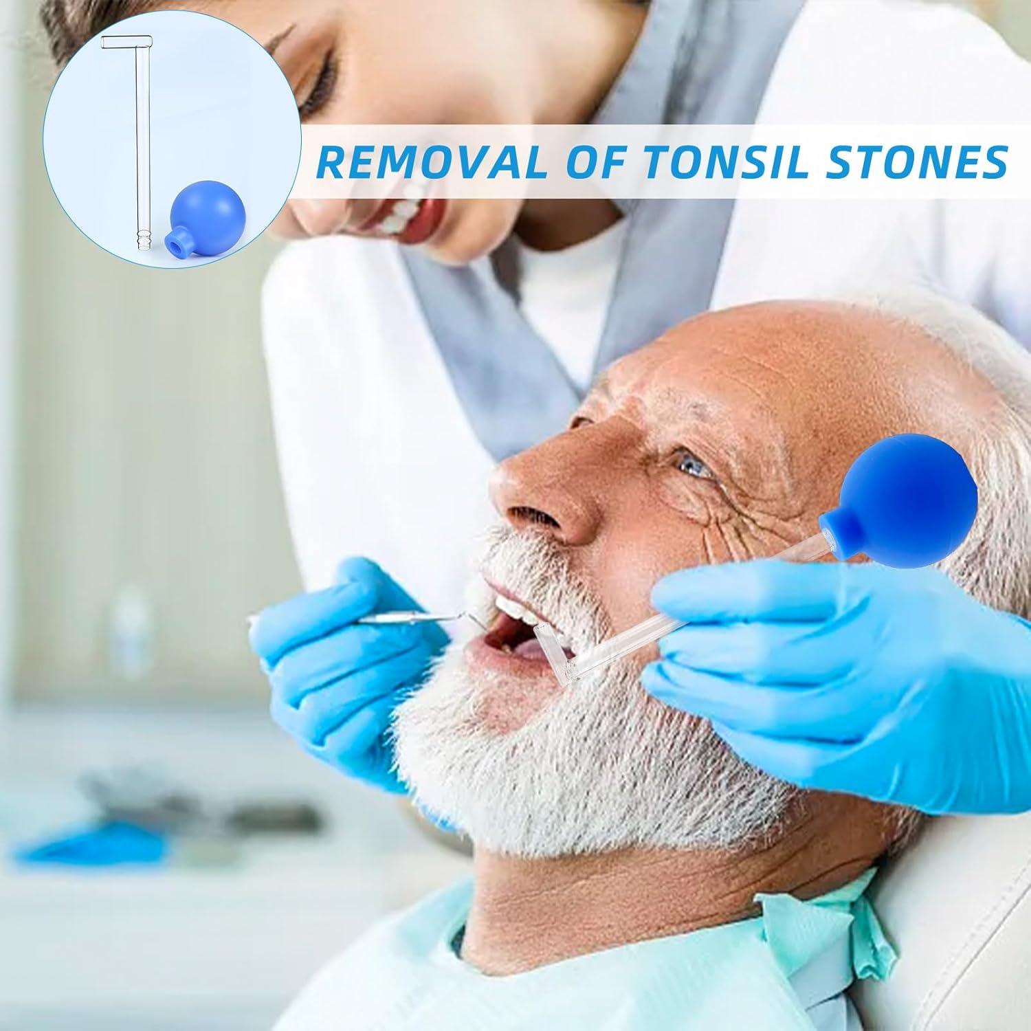 Almond Stones Cupping Glass - Eliminate Tonsil Stones & Bad Breath ...