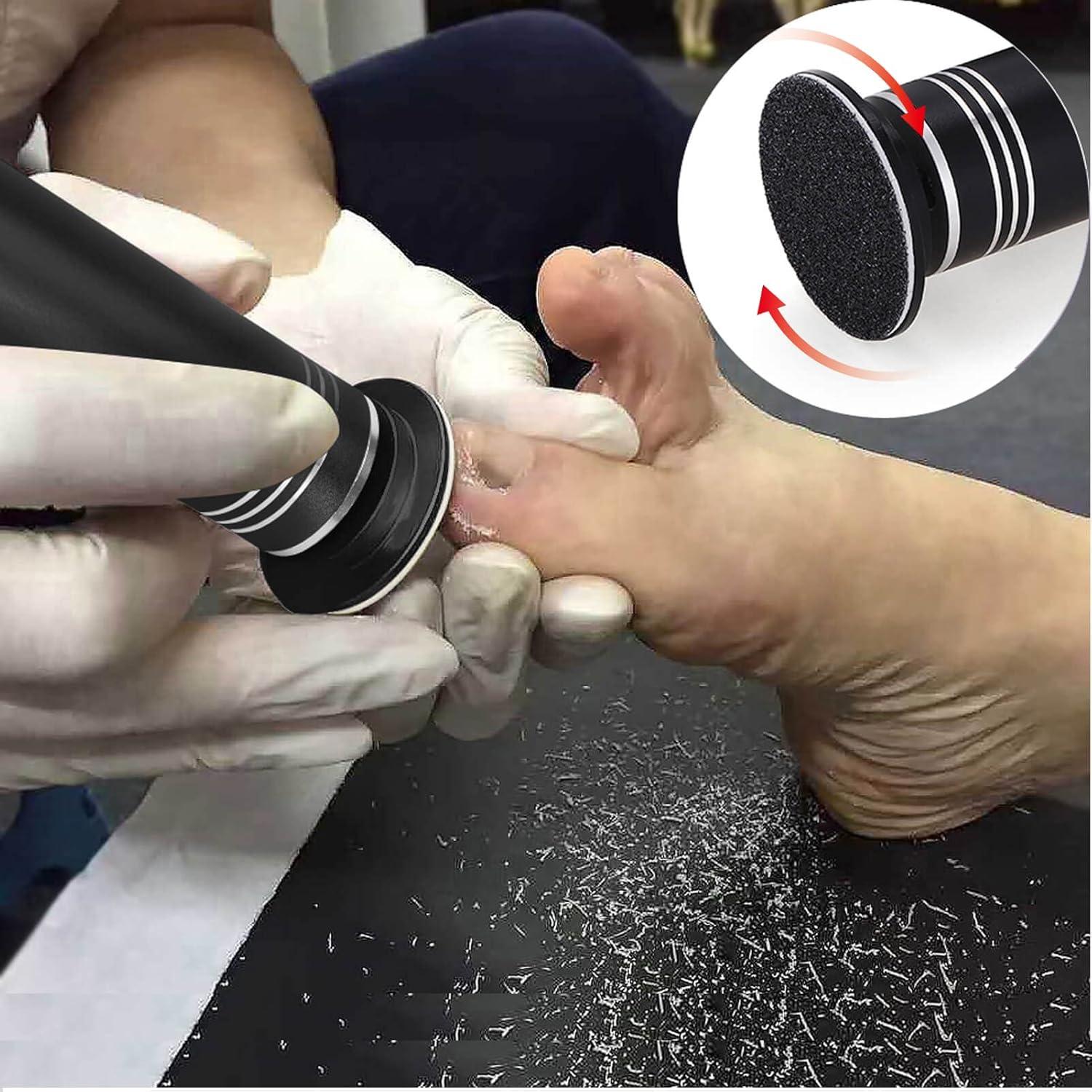 Professional Electric Corn remover - Adjustable Speed Pedicure Tool ...