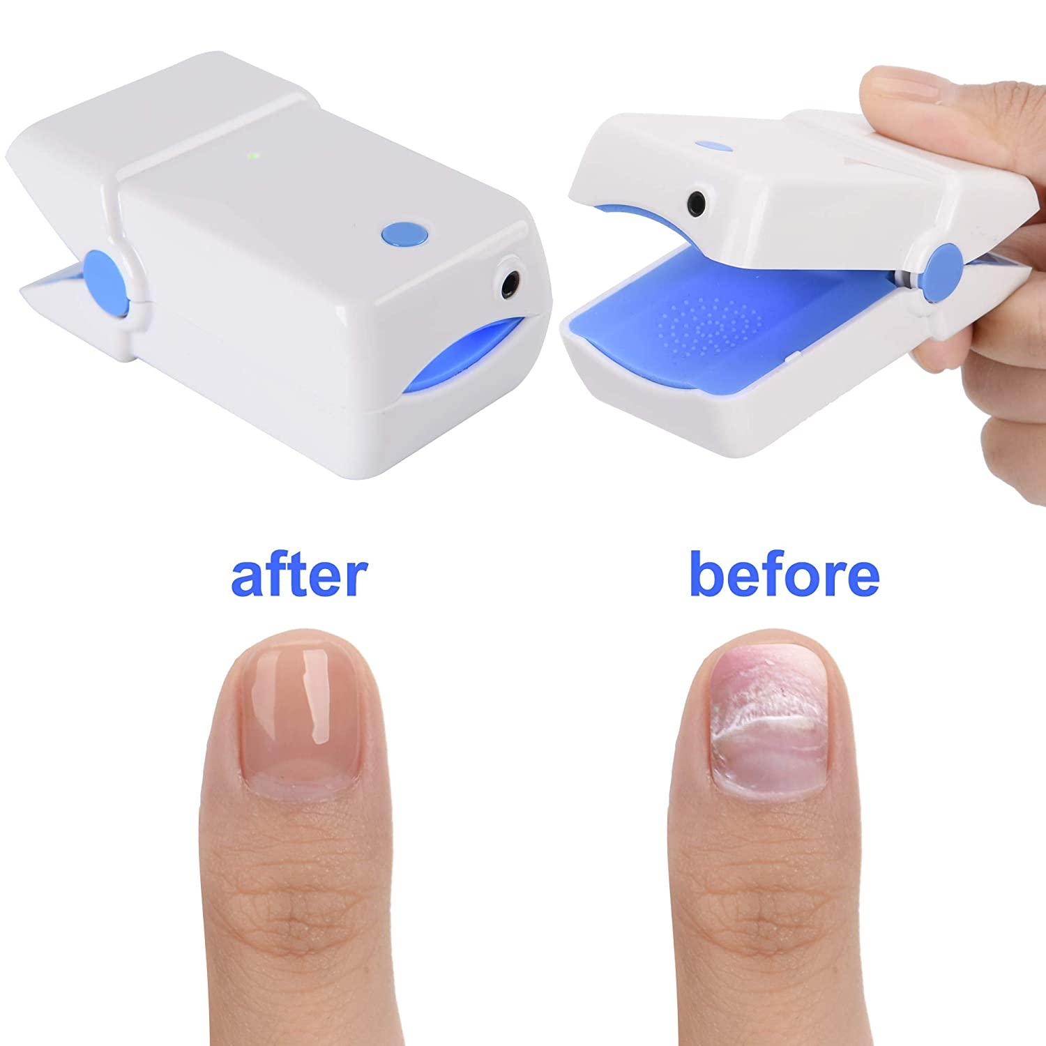MAGNETOE Portable Nail Therapy Device | October 2021 Edition for Toes ...