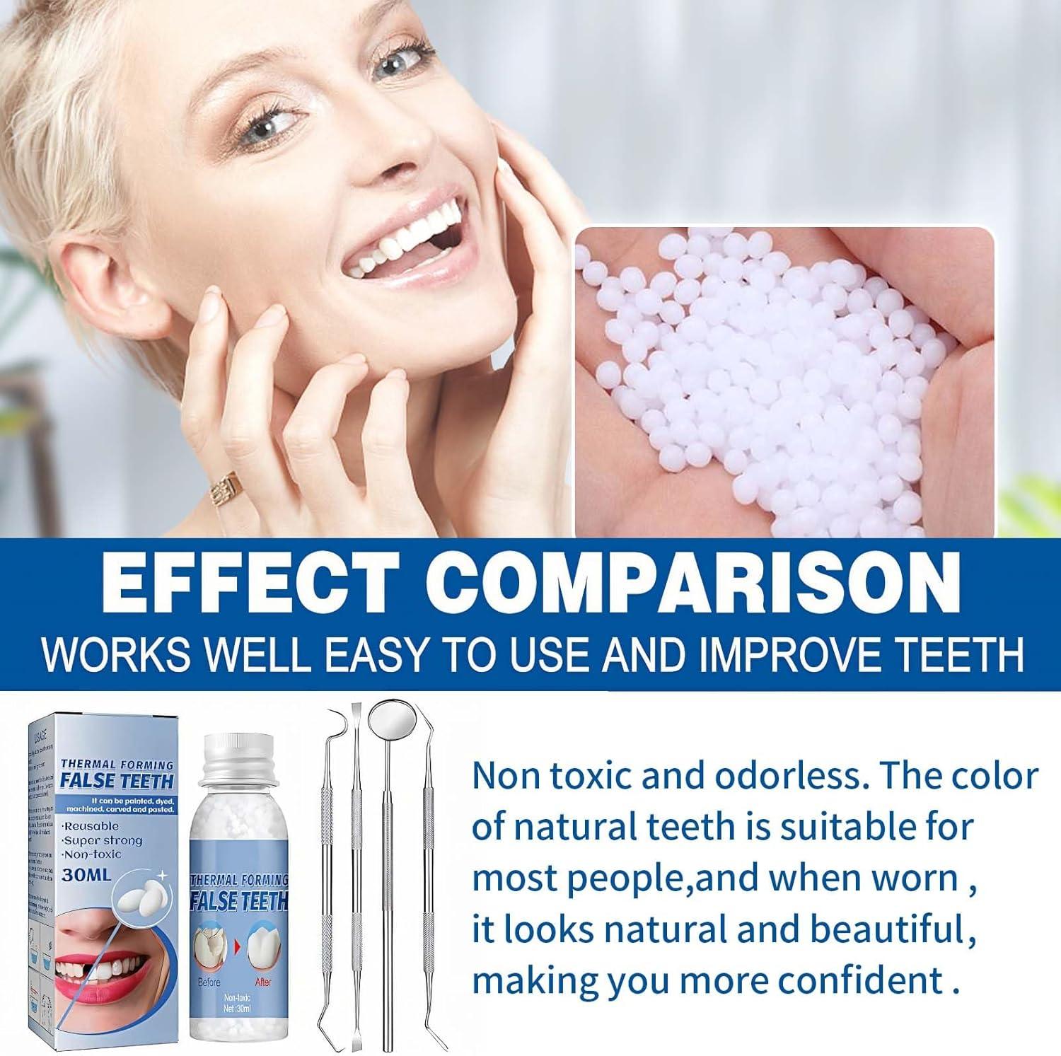 Allony Temporary Dentures & Tooth Repair Kit | Durable Dental Care for ...