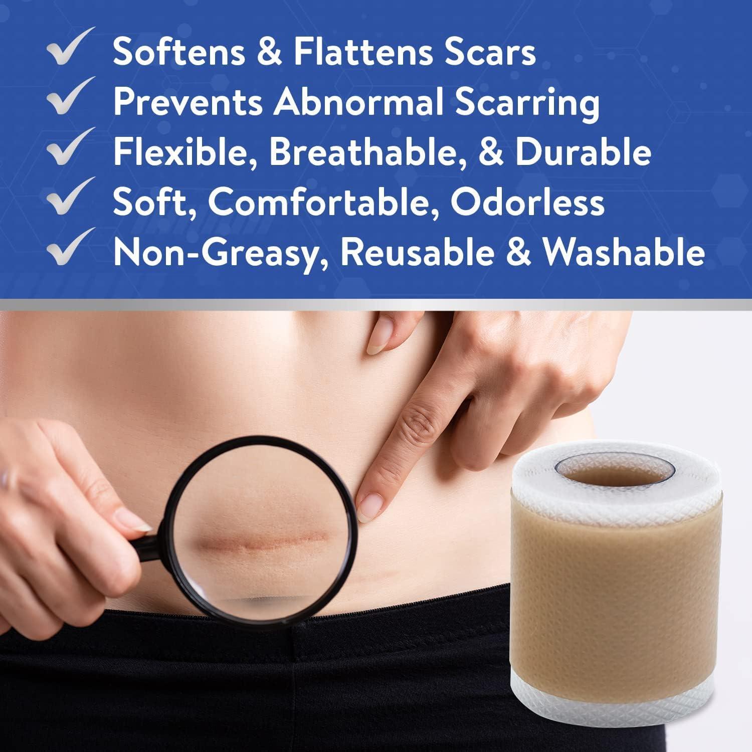 Retailio Silicone Scar Sheets - Soften, Flatten Scars, C-Section ...