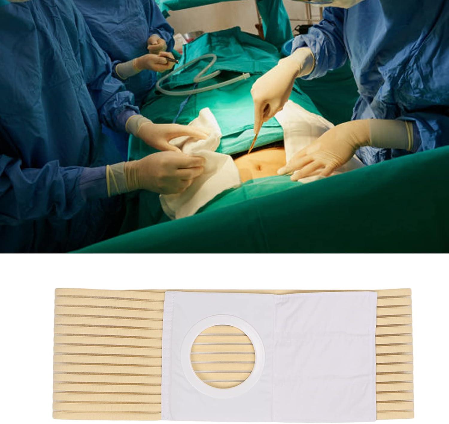 Stomage XL Breathable Elastic Hernia Support Belt for Colostomy ...