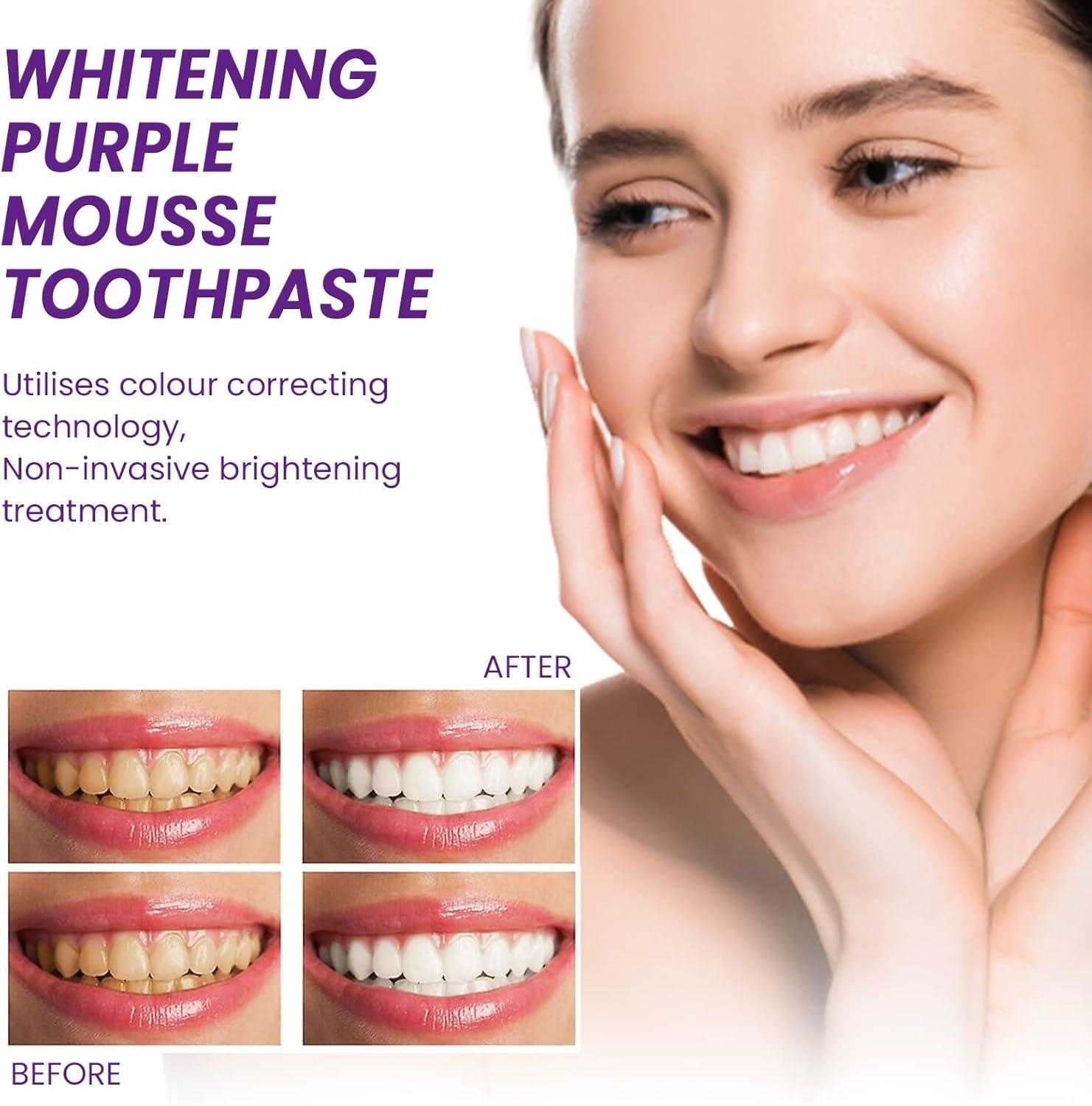 Natural Tooth Whitening Toothpaste | Purple Formula for Yellow Teeth ...