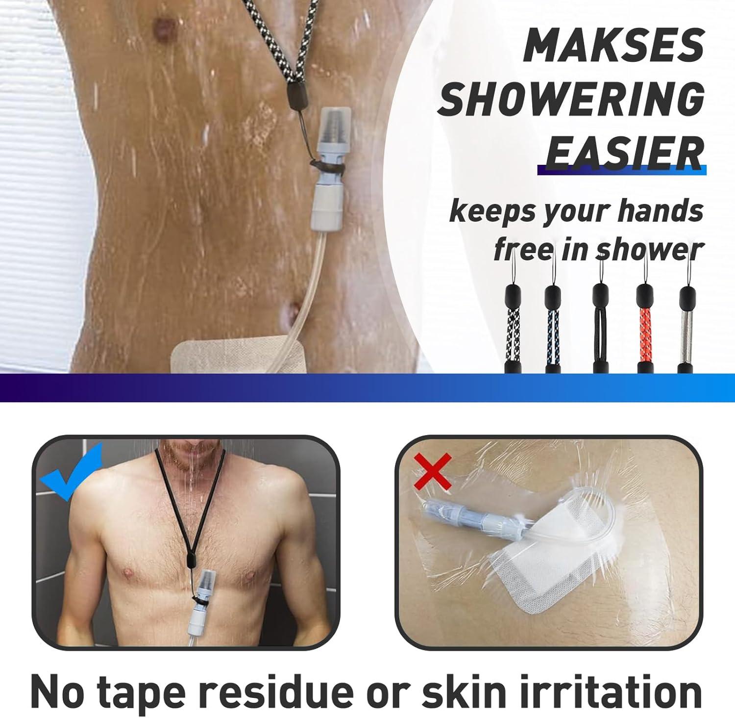 Buy 5 Sets Peritoneal Dialysis Accessories | Adjustable PD Catheter ...