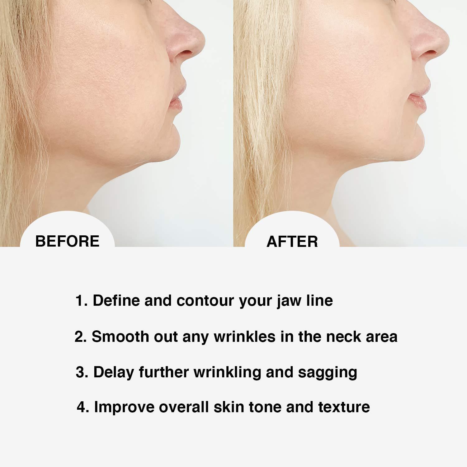 DermaSet Neck and Jawline Cream | Firming & Reducing Double Chin ...