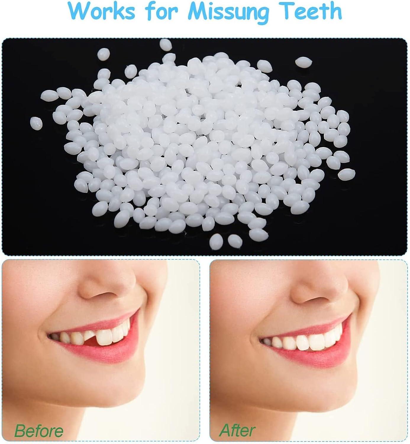 Flipped Warm 2 Pairs False Teeth Veneers | Cosmetic Tooth Covers ...