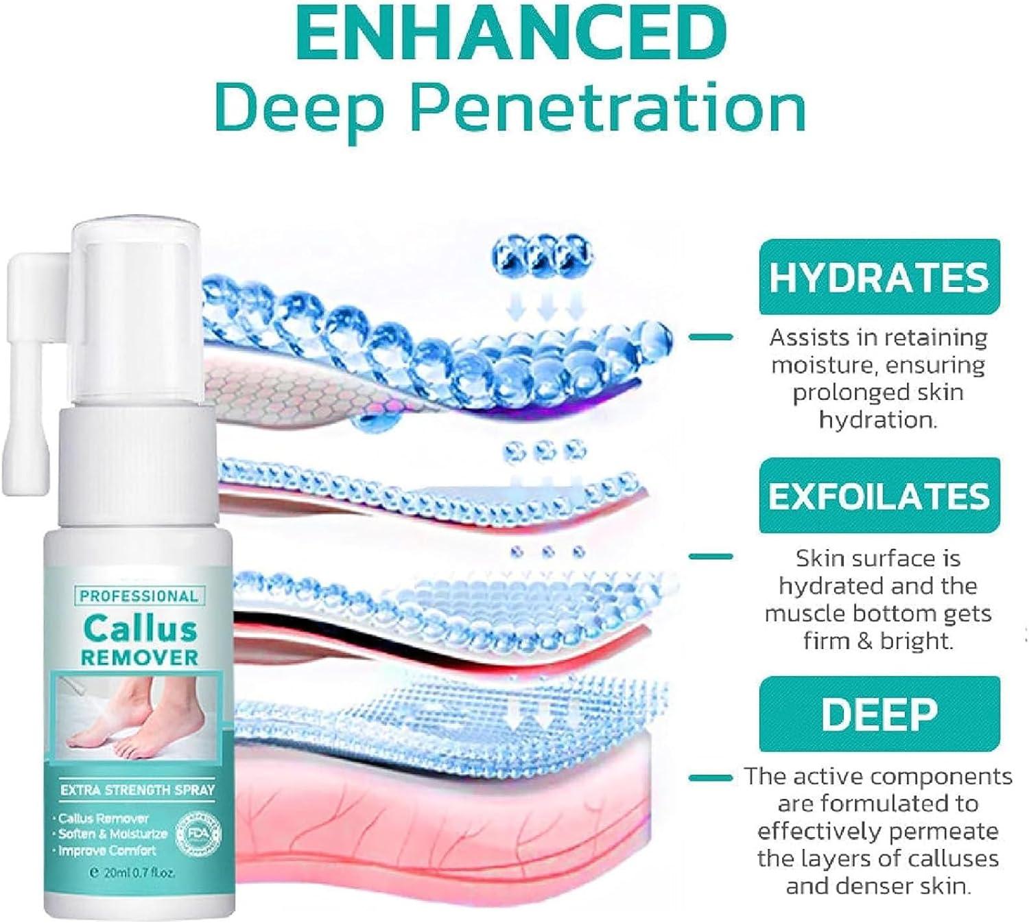 Professional Callus Remover Extra Strength Spray Foot Callus Removal ...