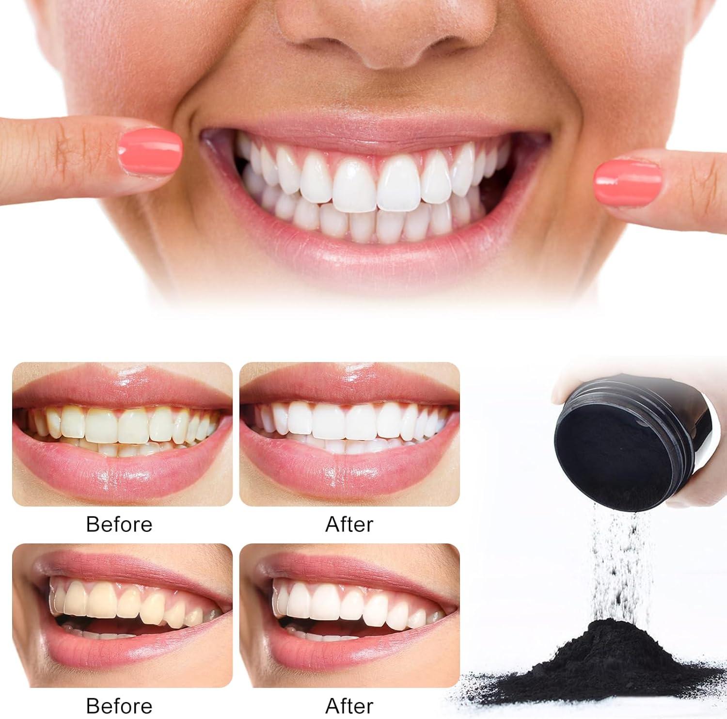 Roinaaid Coconut Shell Tooth Whitening Powder - 4 Pieces for Bright ...