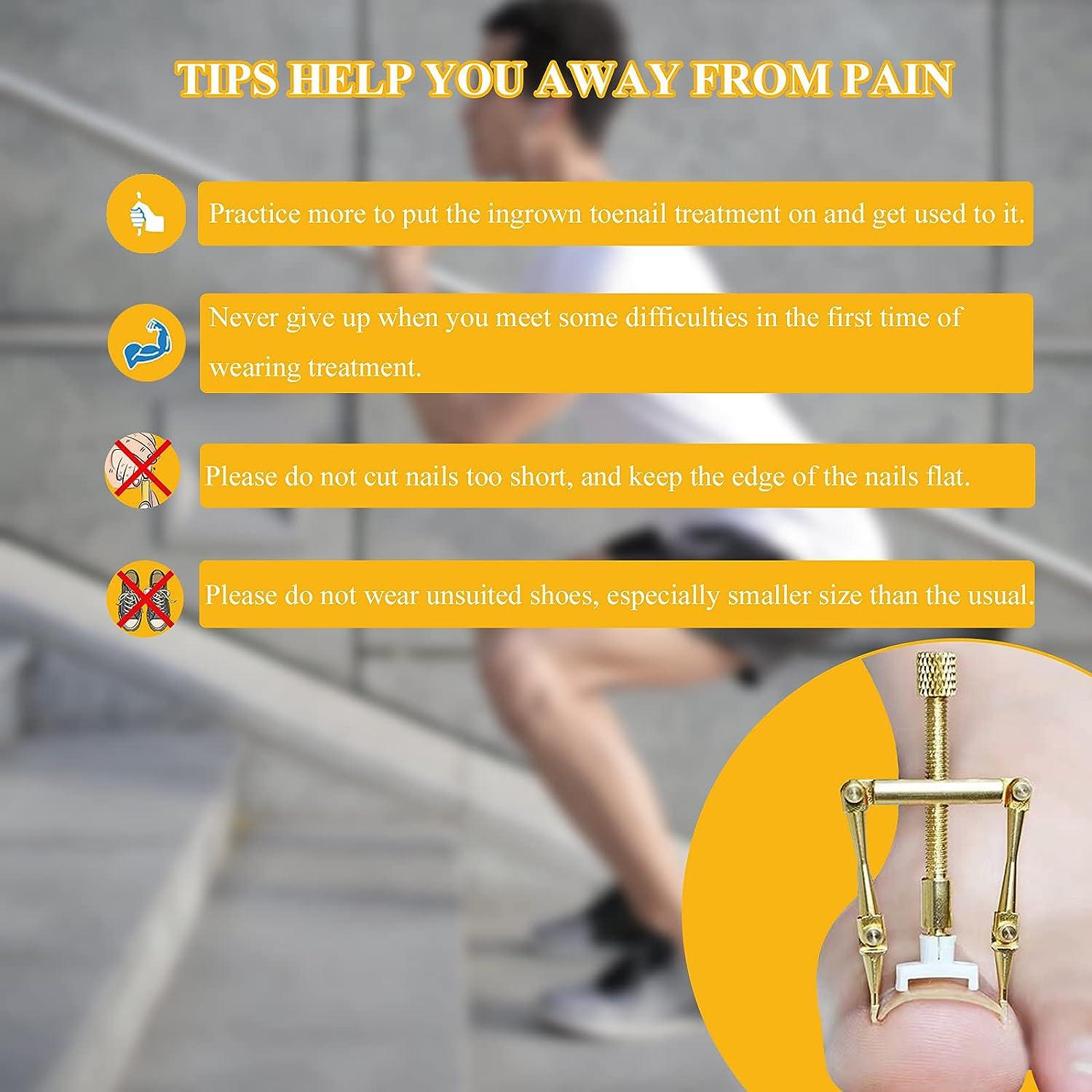 Ingrown Toenail Treatment Kit - Stainless Steel Corrector for Curved ...