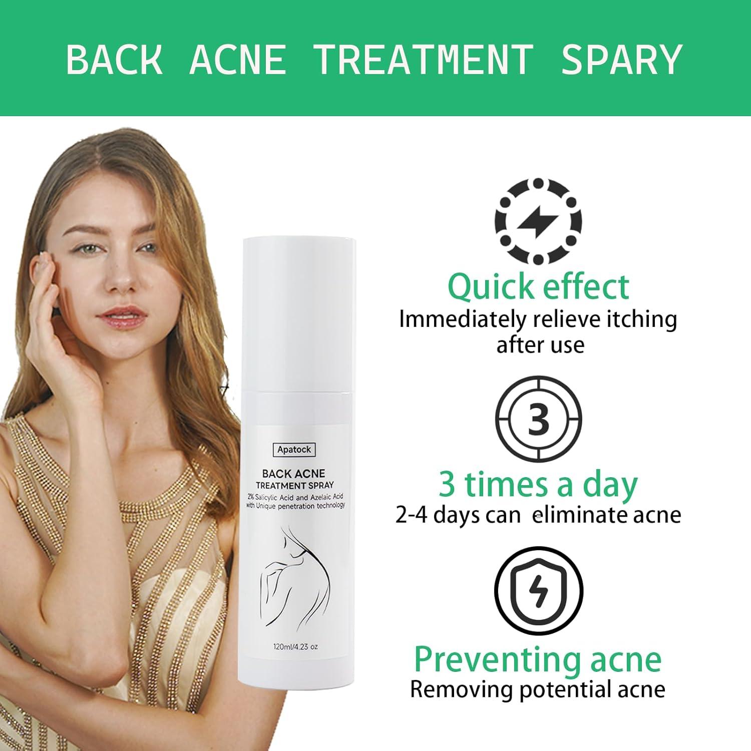 Back Acne Spray - 2% Salicylic Acid & Azelaic Acid Treatment for Body ...