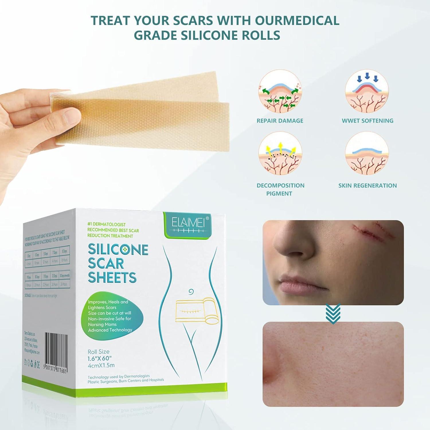 Silicone Scar Tape 1.6 x 60 Roll-3M | Effective Scar Removal Sheets for ...
