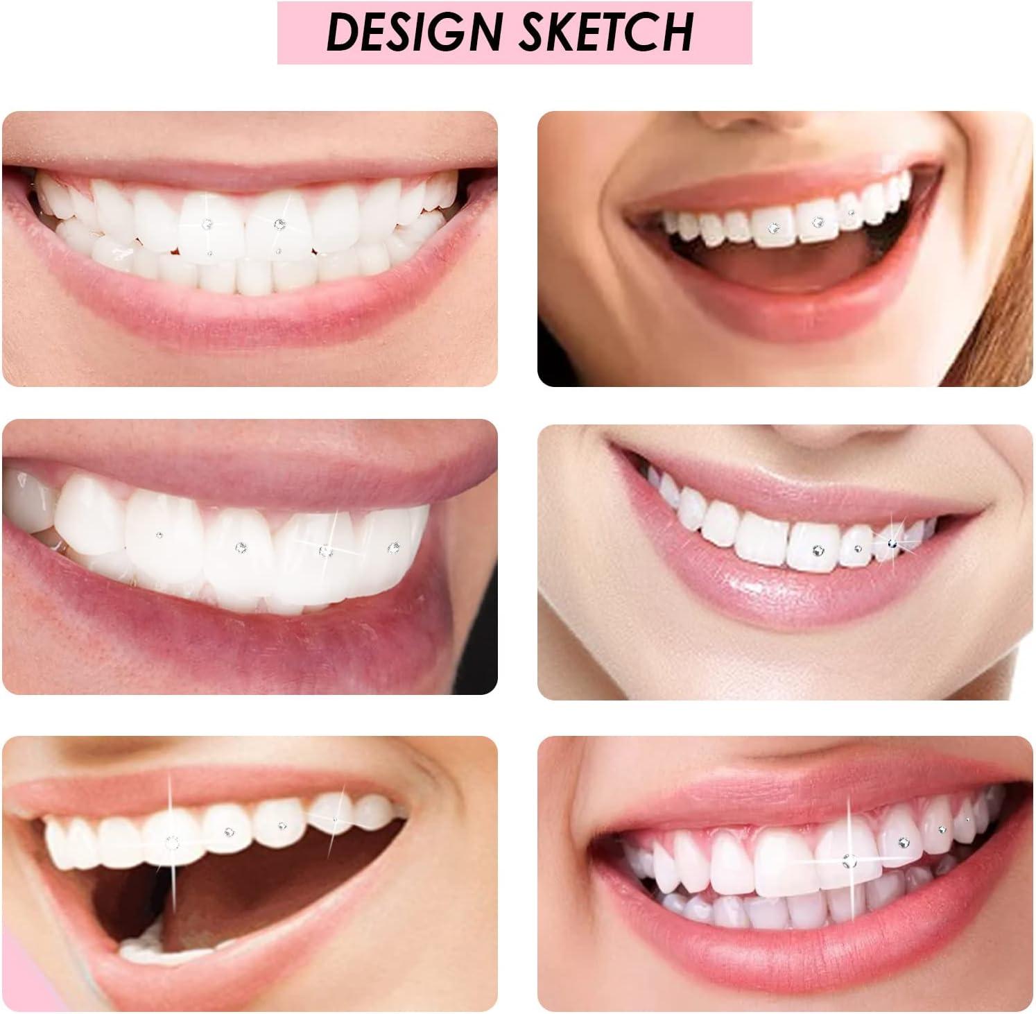 Dyceittdia Zahn-Edelstein-Kit - DIY Tooth Decoration with Butterfly ...