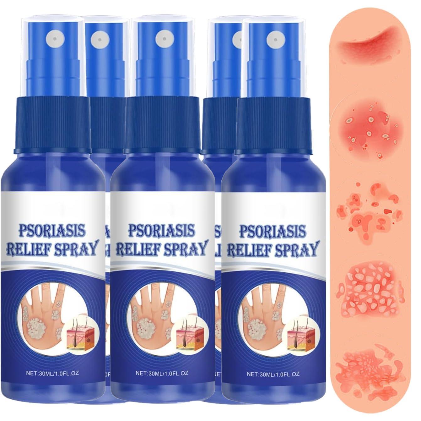 XRCZYM South Moon Psoriasis Repair Spray - Professional Relief ...