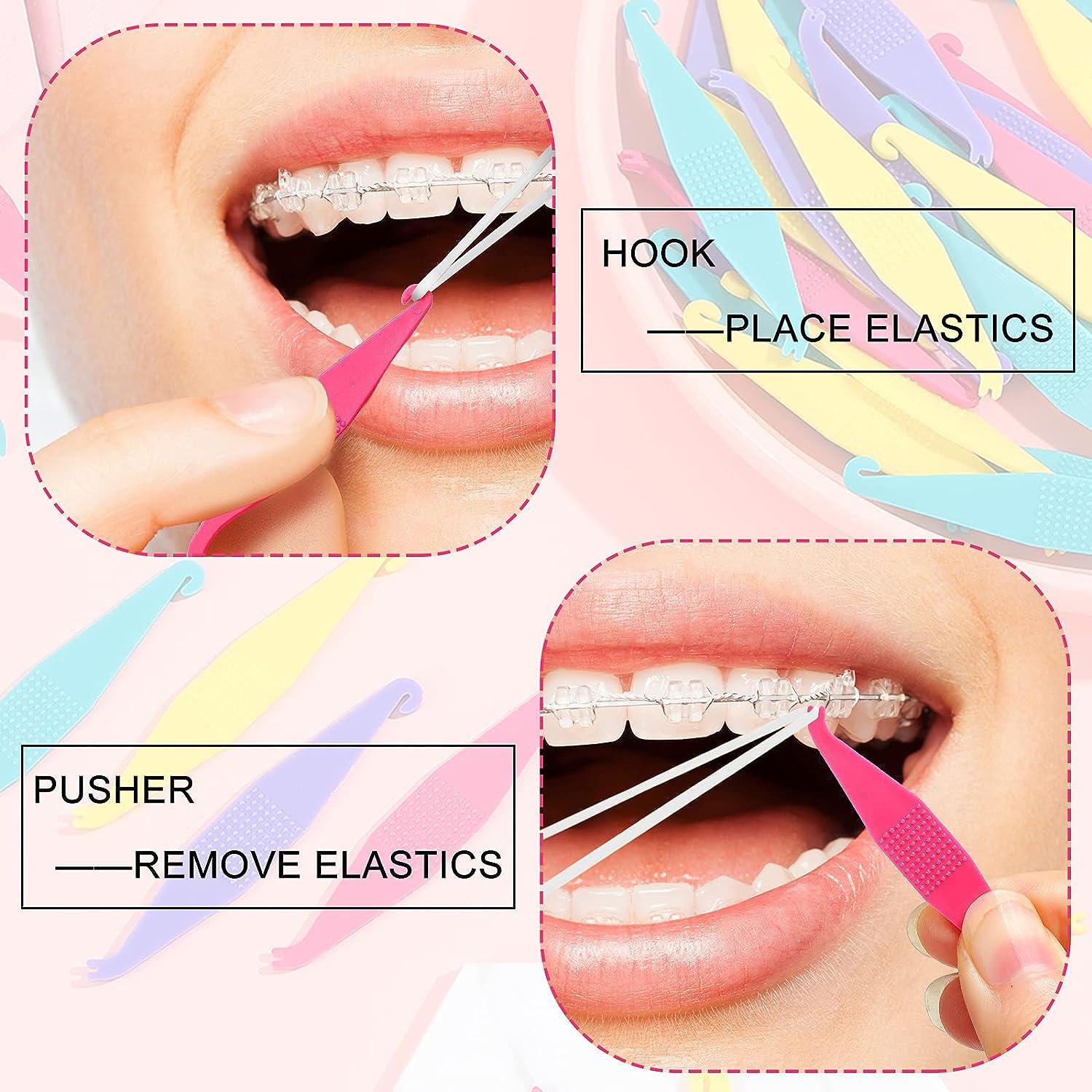 50 Pcs Disposable Elastic Placers for Braces - Multicolored Rubber Band ...