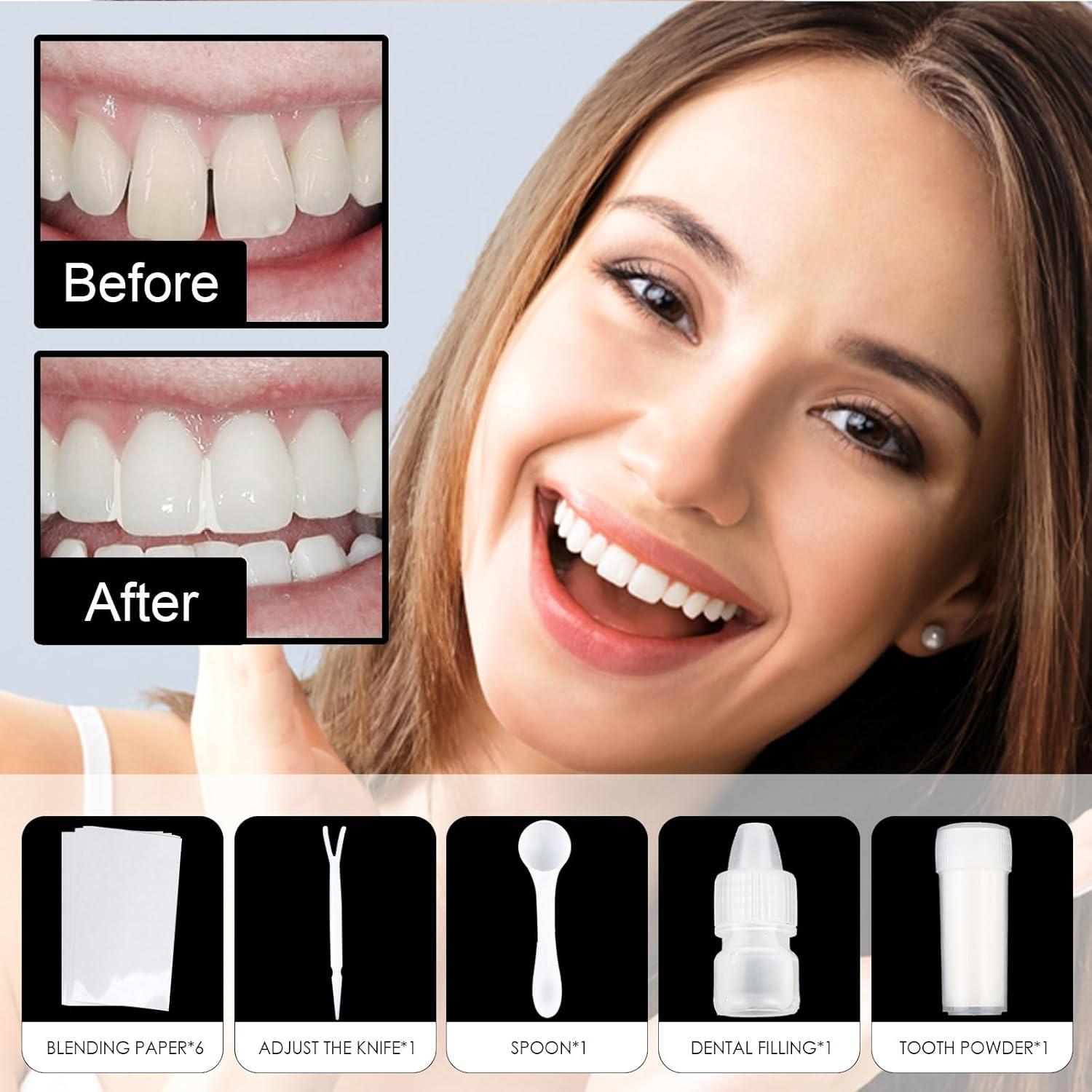 Tooth Repair Kit - Dentures Dental Adhesive Set | Temporary Veneers ...