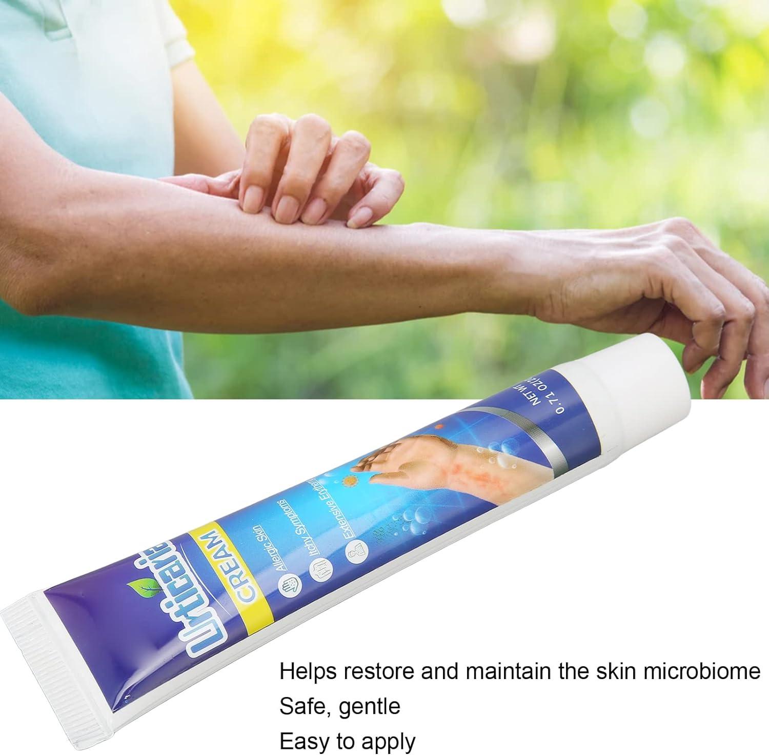 Anti-itch Cream Pain Relief Urticaria Relief Itching Ointment Dry Skin ...