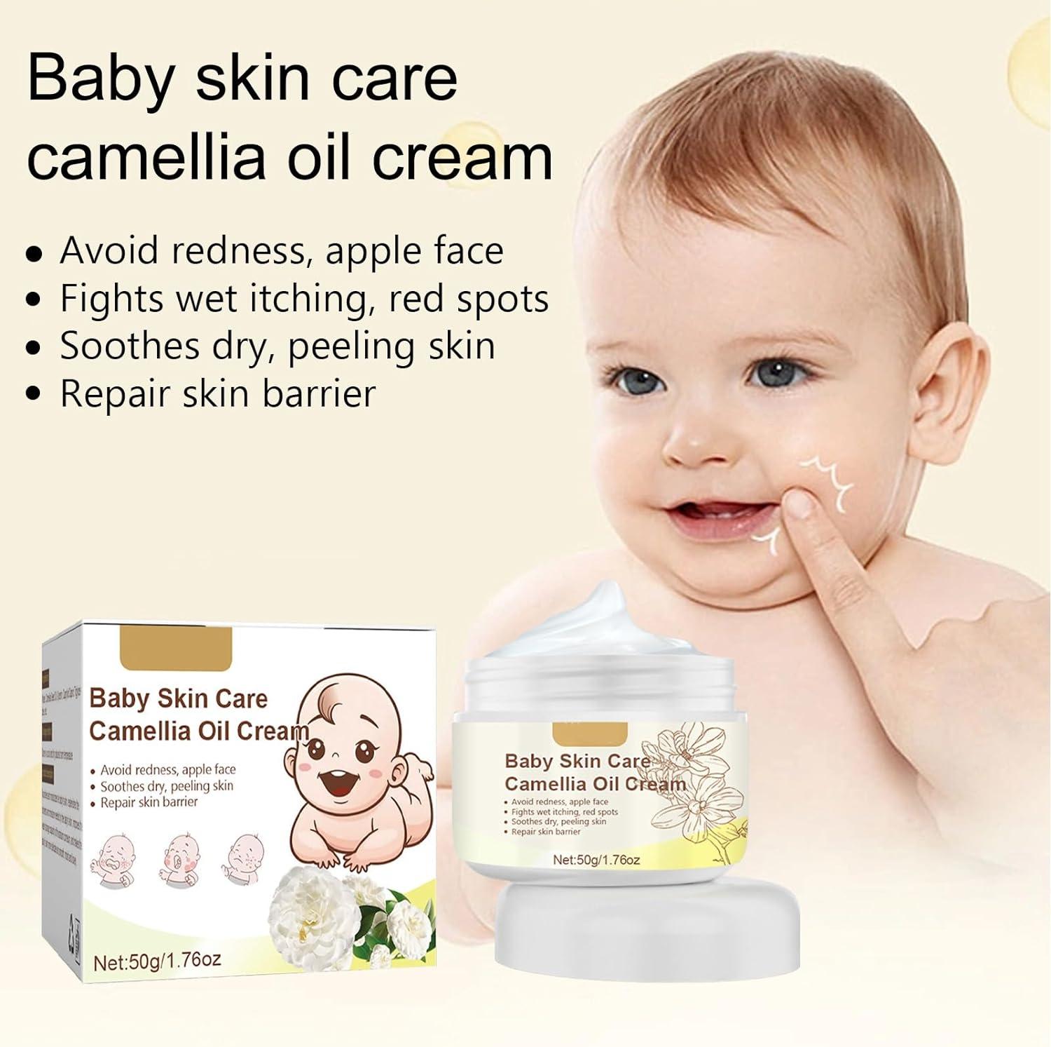 Baby Skin Cream Gentle Skin Relief Cream Deep Hydration Skin Relief ...