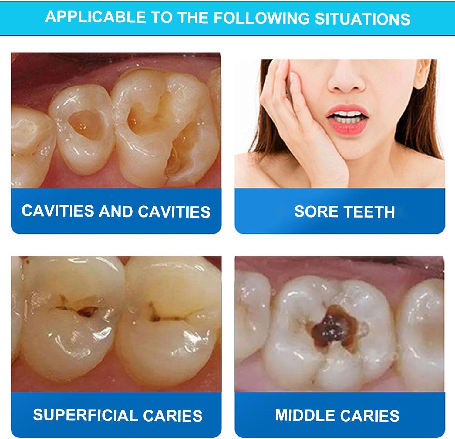 Skhaovs 100-Piece Temporary Tooth Crown Denture Set - Provisional ...