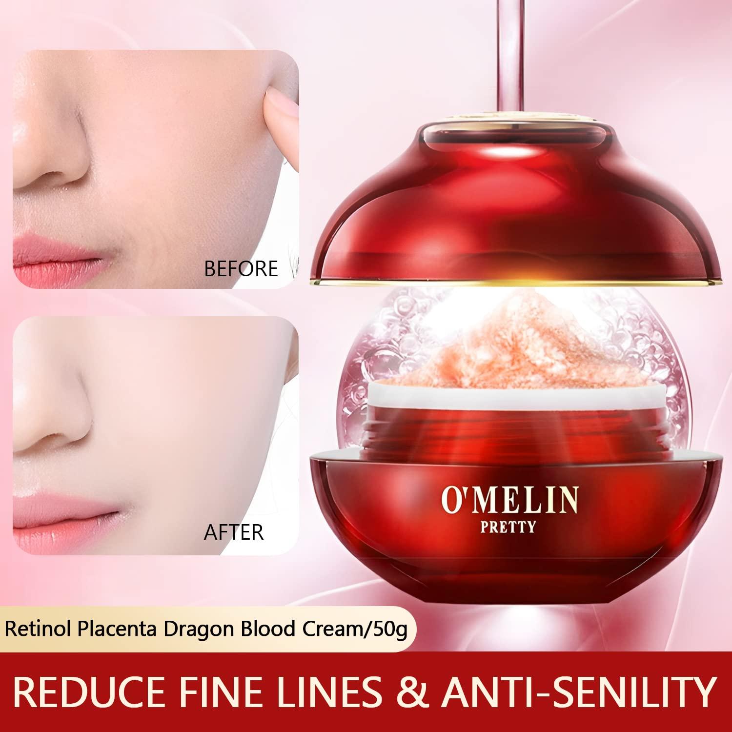 Retinol Placenta Royal Dragon Blood Cream - Anti-Aging Face Moisturizer ...