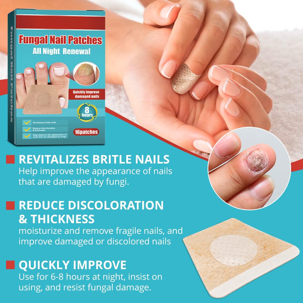 8-Hour Overnight Nail Repair Patches - 48Pcs (3 Packs) for Damaged ...