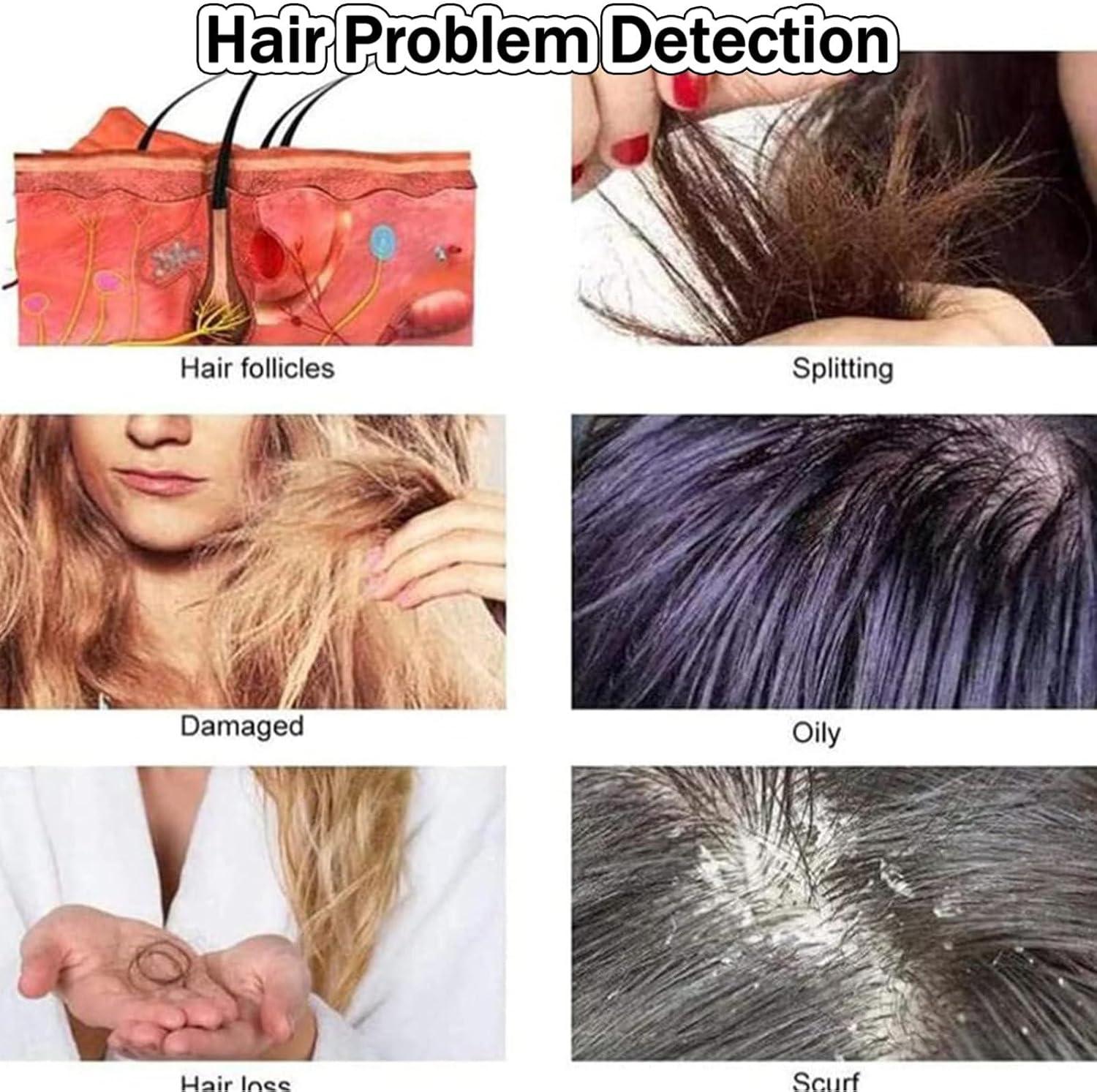 10.1inch Skin Scalp Detector Skin Diagnosis Hair Analyzer Hair ...
