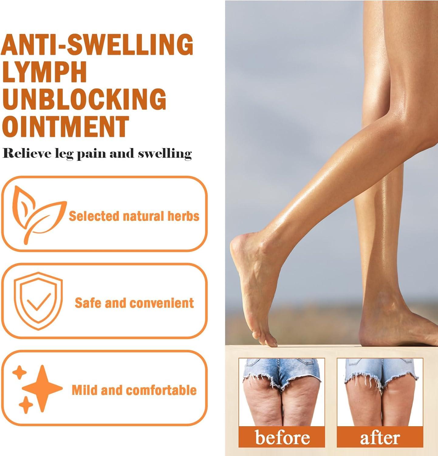KOAHDE Gingerlegs Anti Swelling Detoxing Ointment Lymphcare Ginger ...
