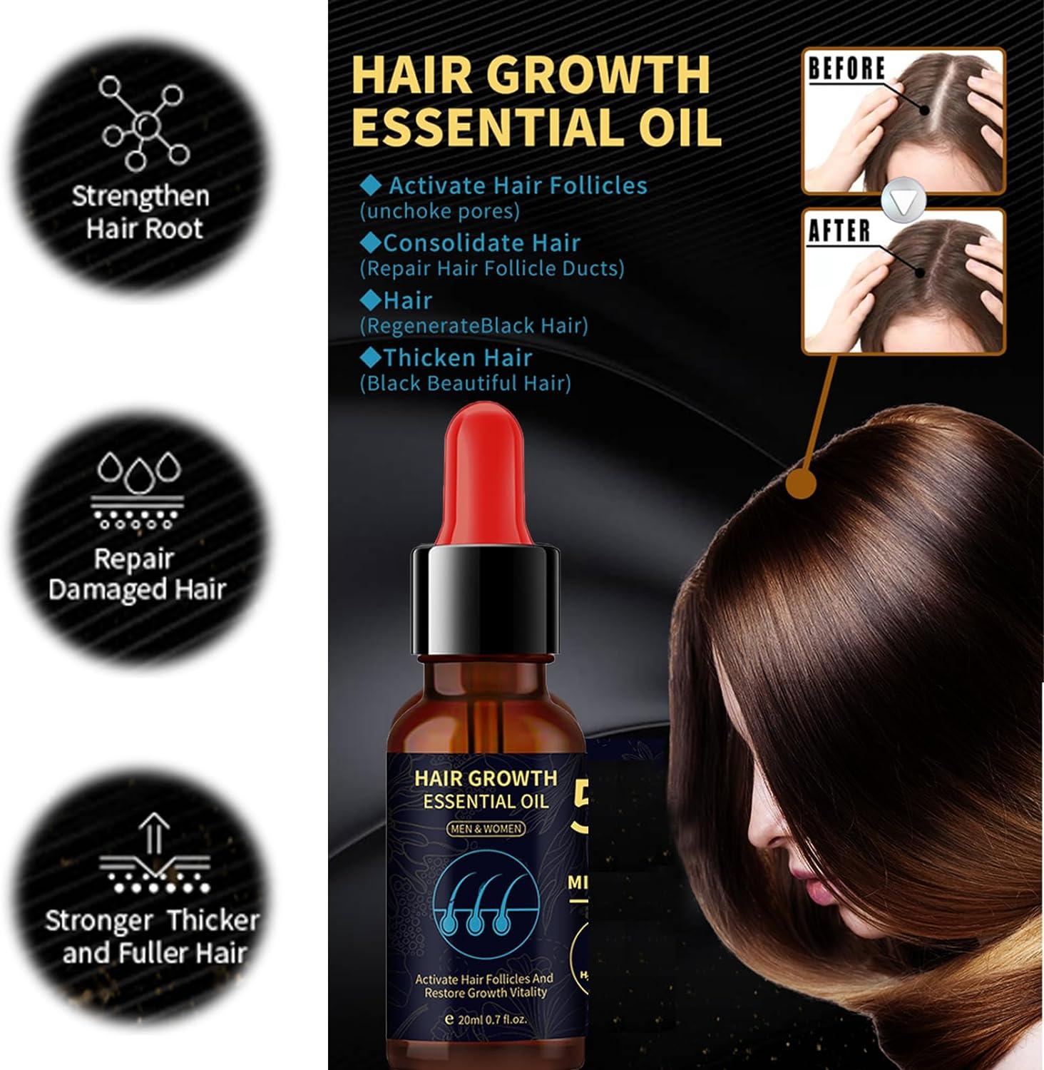 Nourishing Hair Growth Oil Serum for All Hair Types - Stimulates Scalp ...