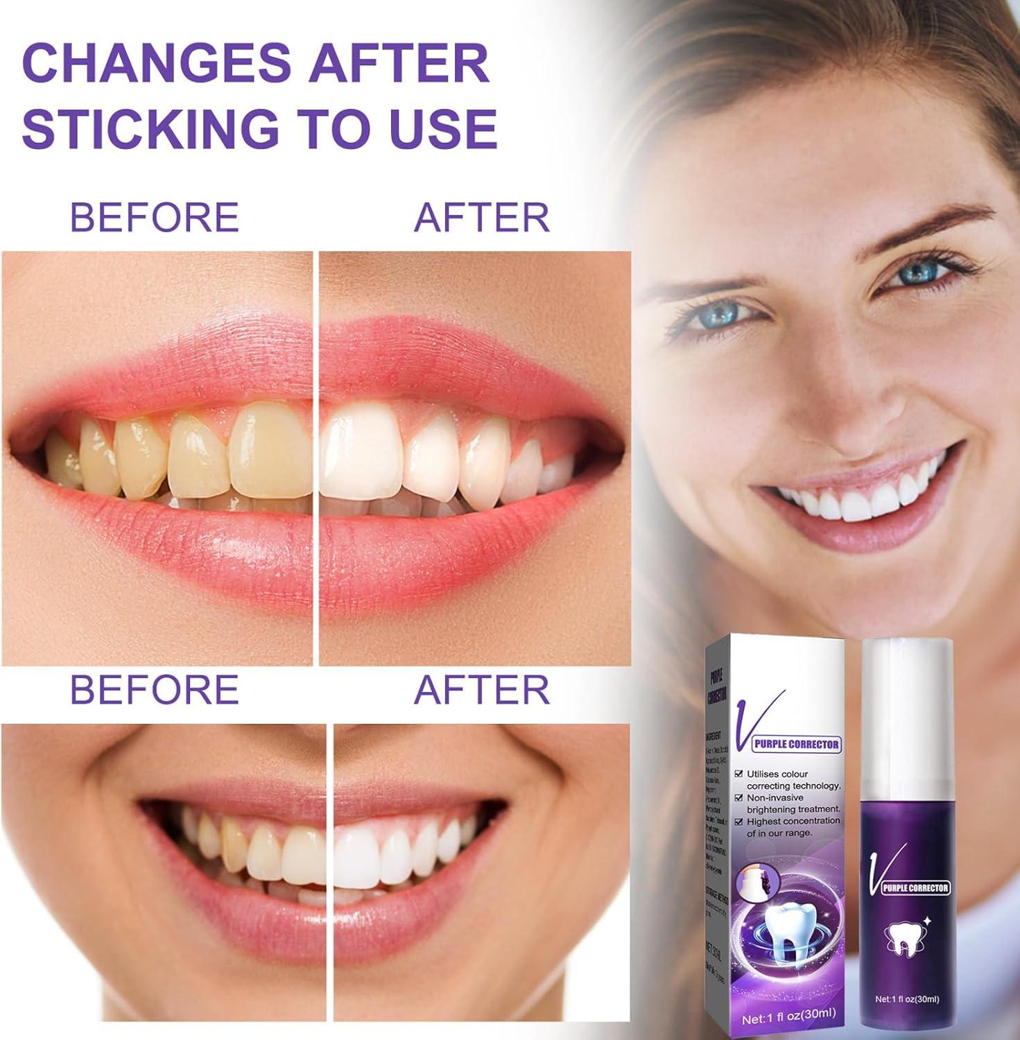 V34 Purple Toothpaste for Whiter Teeth - Lighten Stains Repair Gums ...