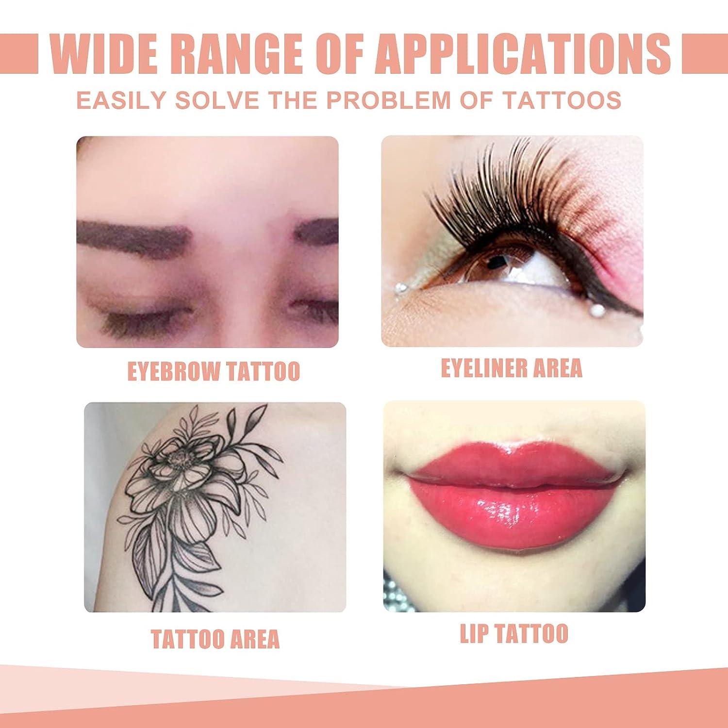 Tattoo Removal Cream - Fast-Acting & Painless Permanent Solution for ...