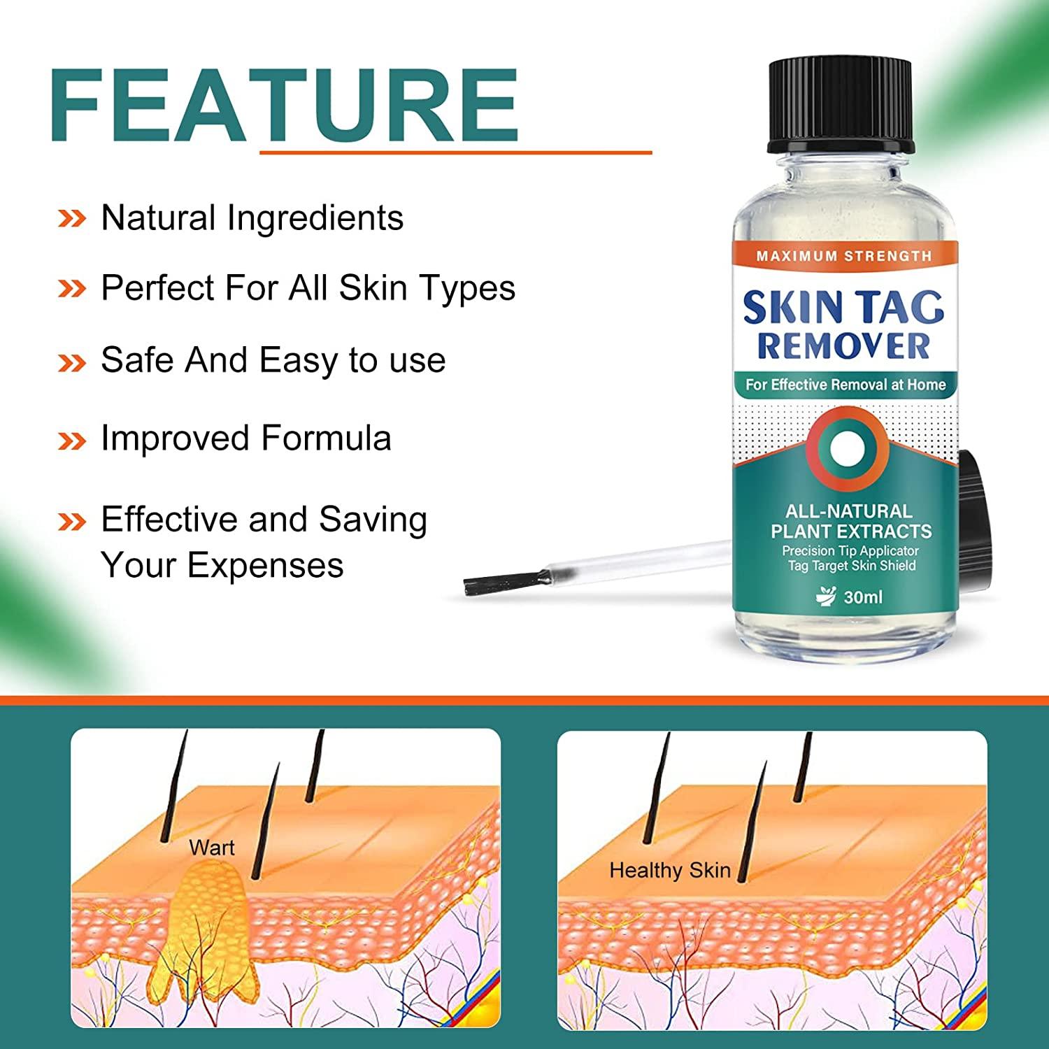 Skin Tag & Mole Remover | Quick & Effective Results | Natural Extract ...