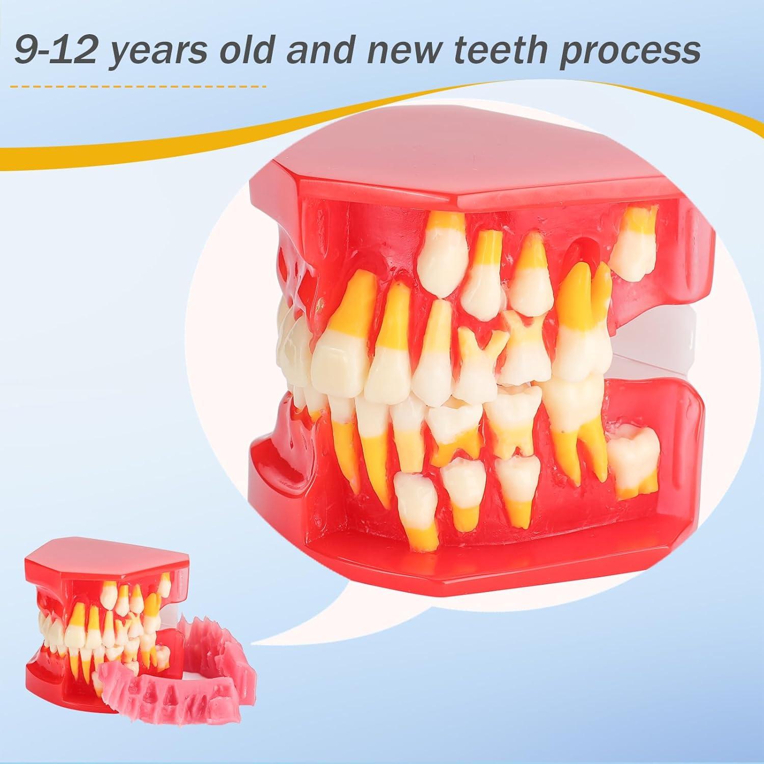 Teeth Eruption Development Model | Visualize Deciduous to Permanent ...