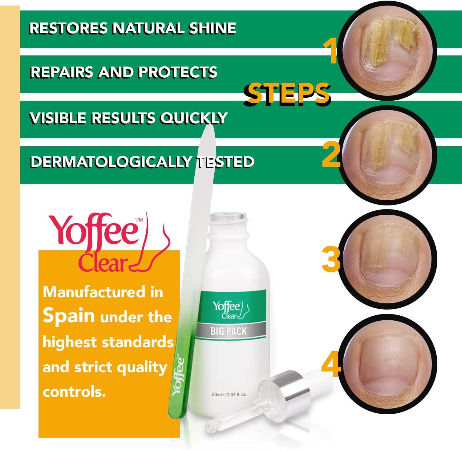 Yoffee Clear Nail Repair and Care 60ml - Fungal Nail Treatment with ...