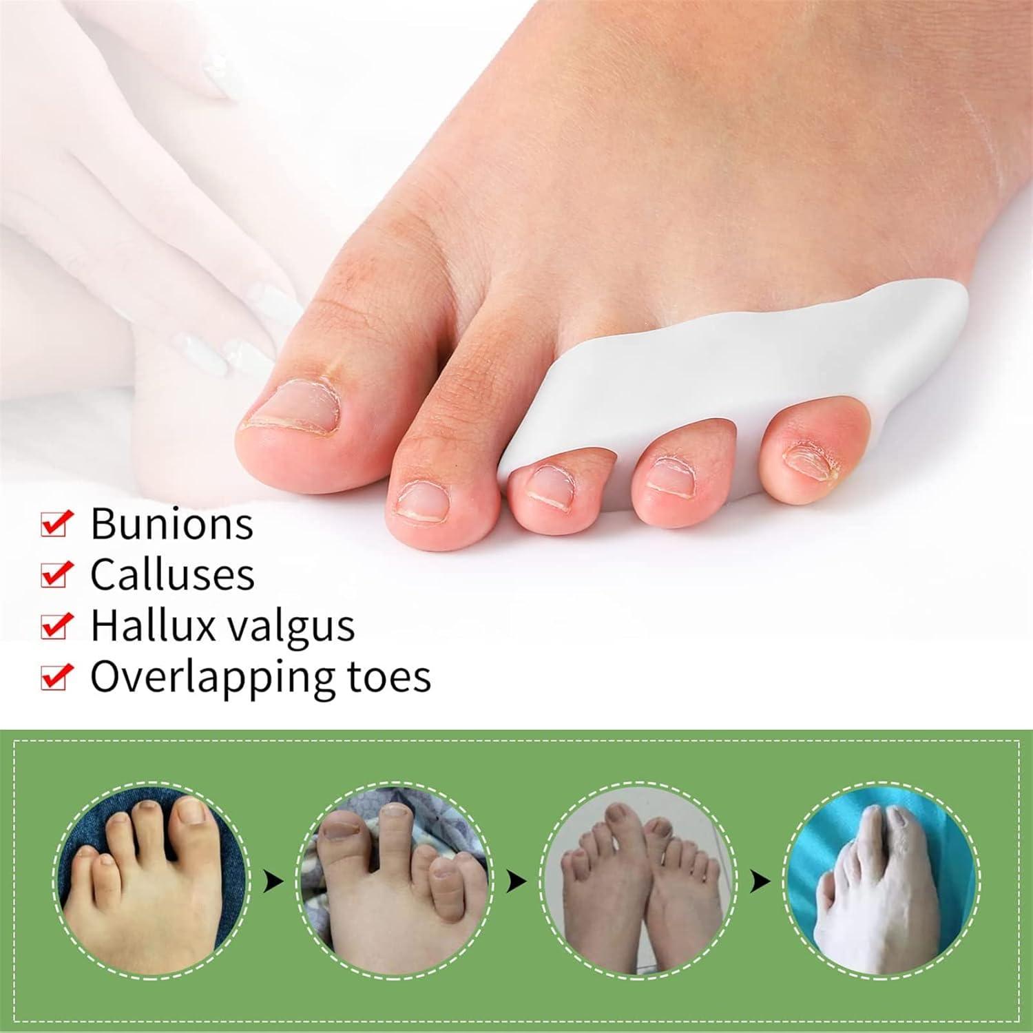 Toe Spreader Silicone - 4 Pcs Small Toe Separator for Overlapping Toes ...