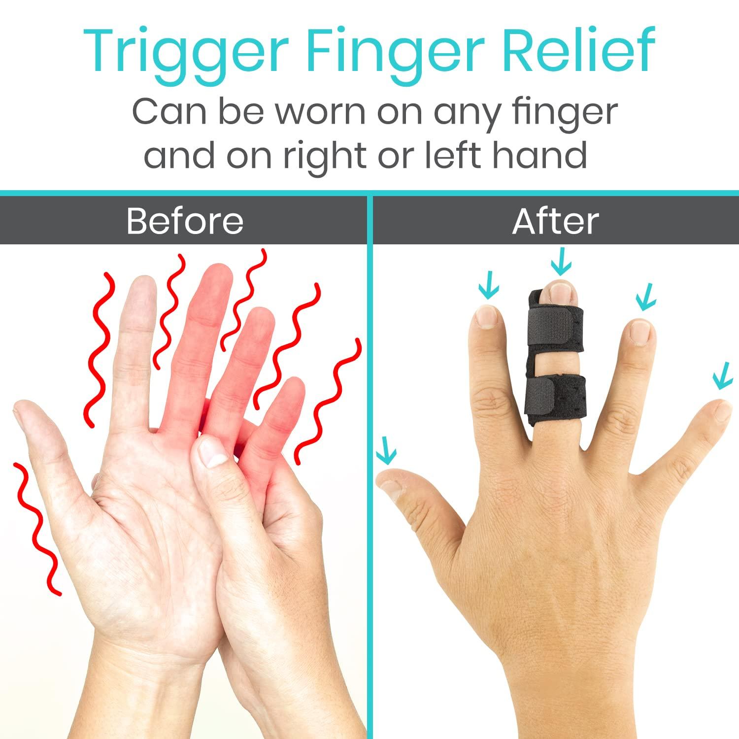 Vive Finger Splint (2 Pack) - Universal Finger Straightener for ...